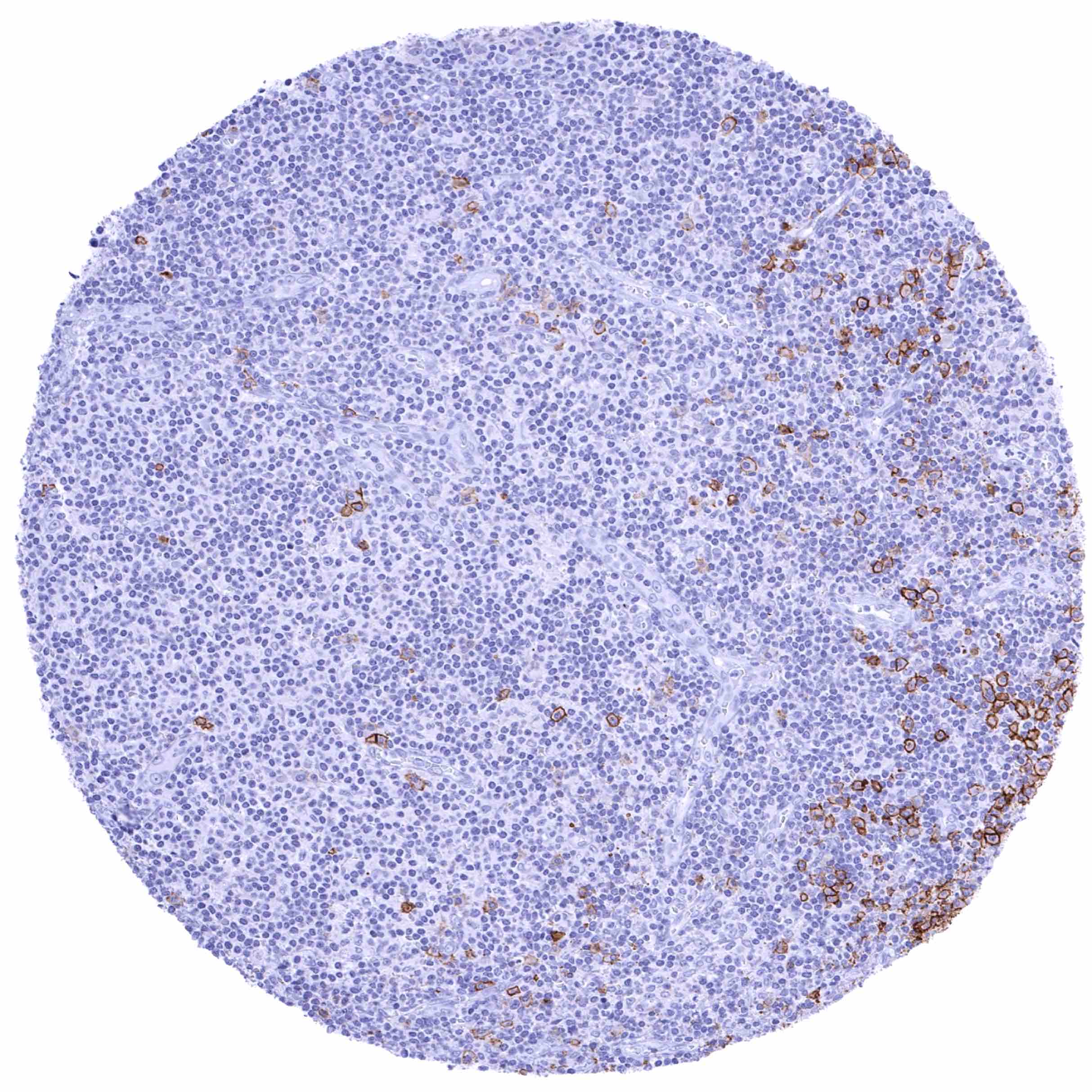 CD38 (MSVA-038R) - MS Validated Antibodies
