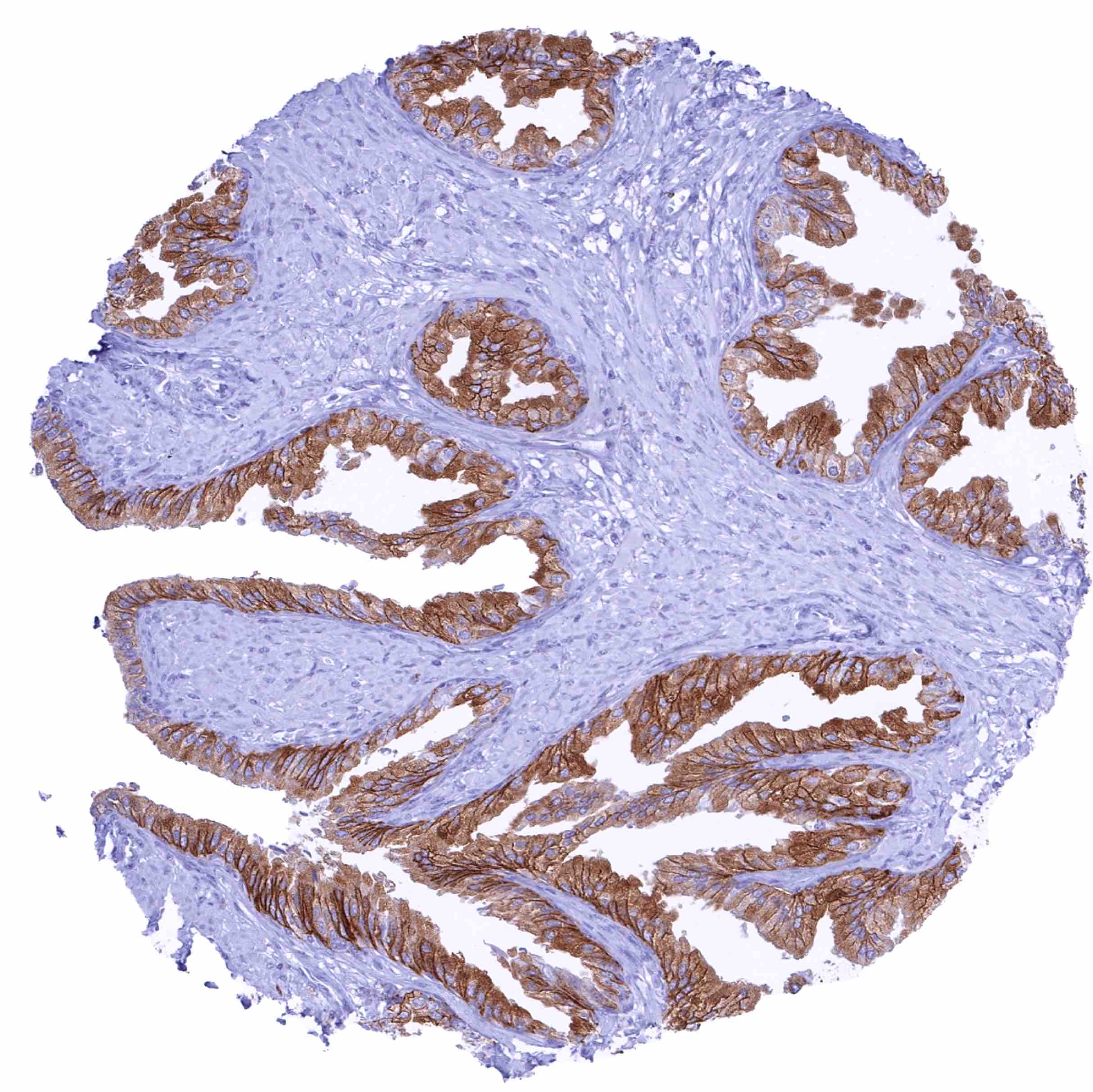 CD38 (MSVA-038R) - MS Validated Antibodies