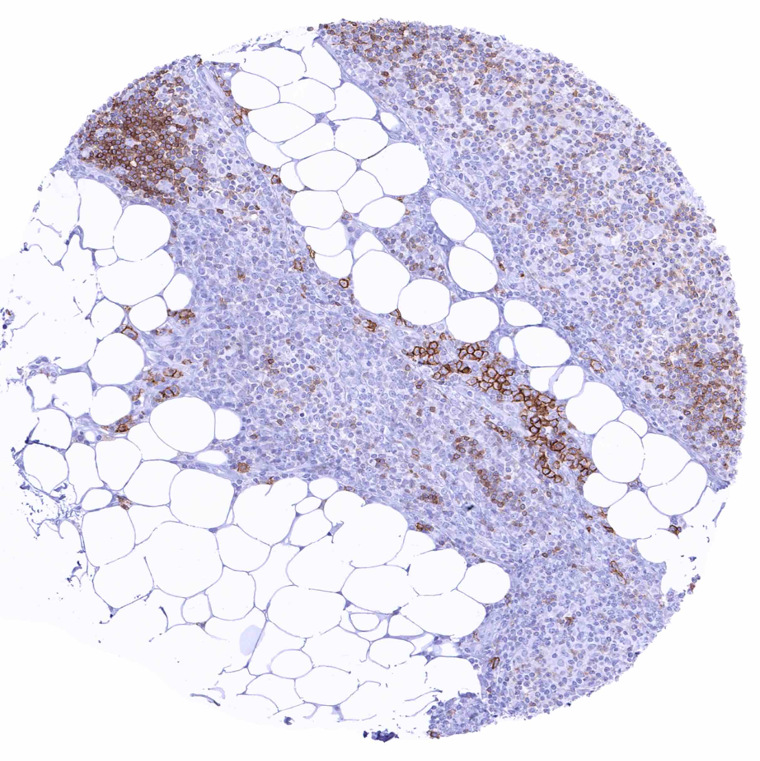 CD38 (MSVA-038R) - MS Validated Antibodies