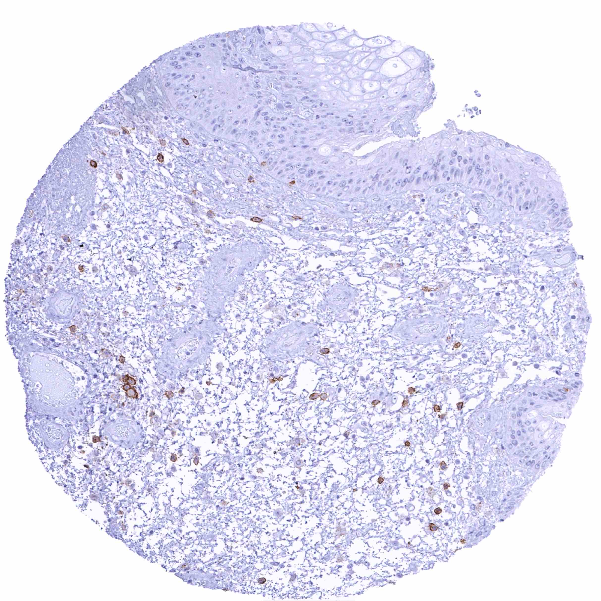 CD38 (MSVA-038R) - MS Validated Antibodies