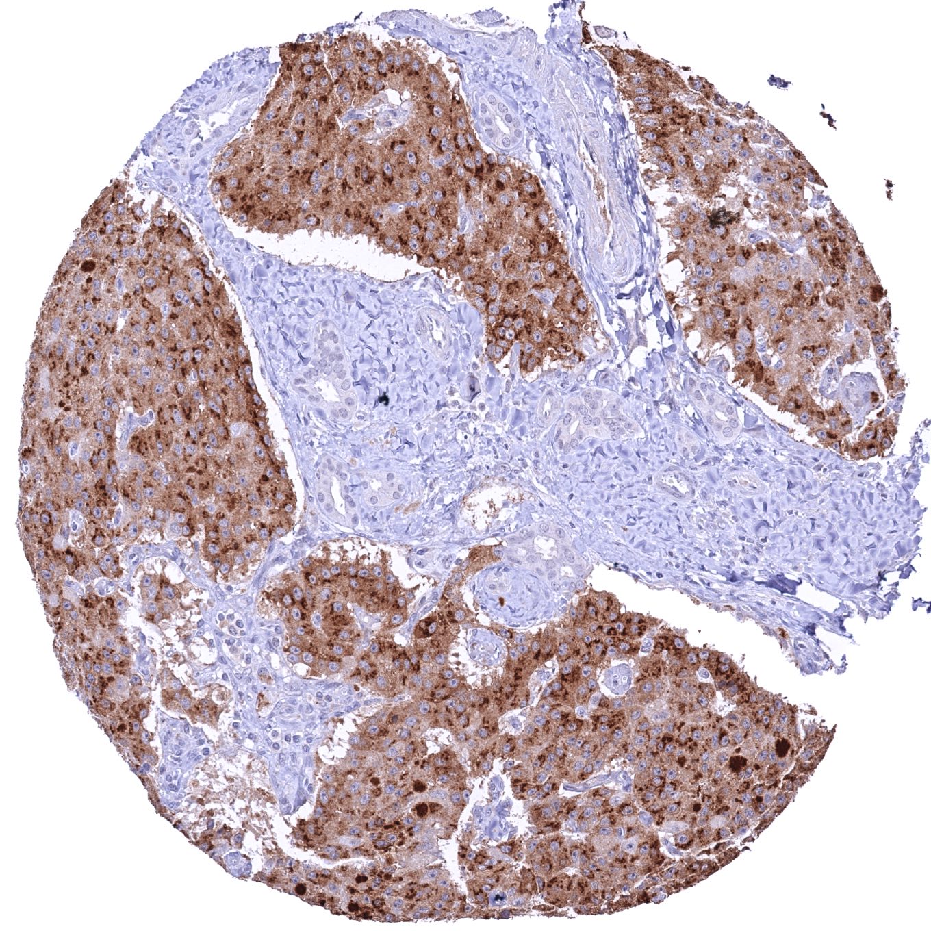 Insulin (HMV308) - MS Validated Antibodies