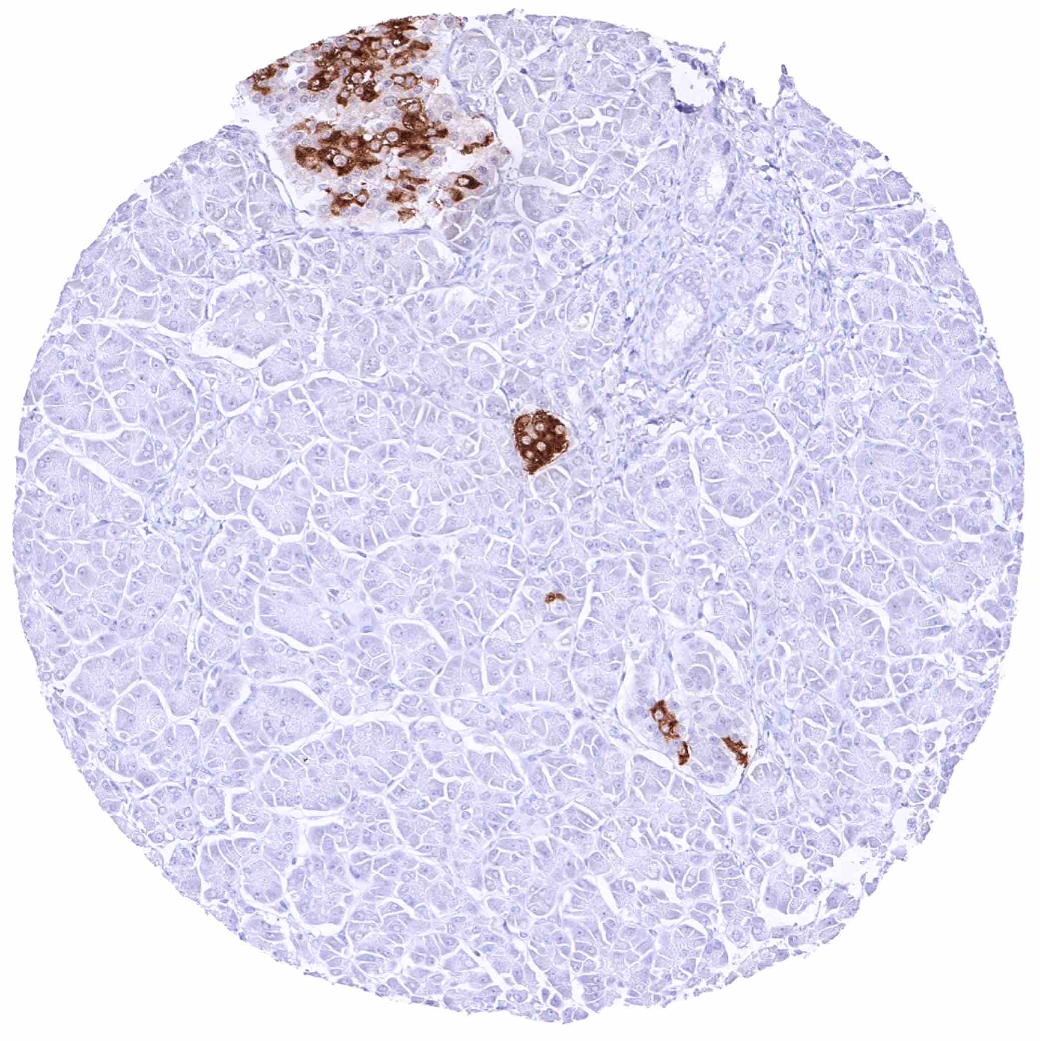 Normal Tissue Gallery Insulin - MS Validated Antibodies