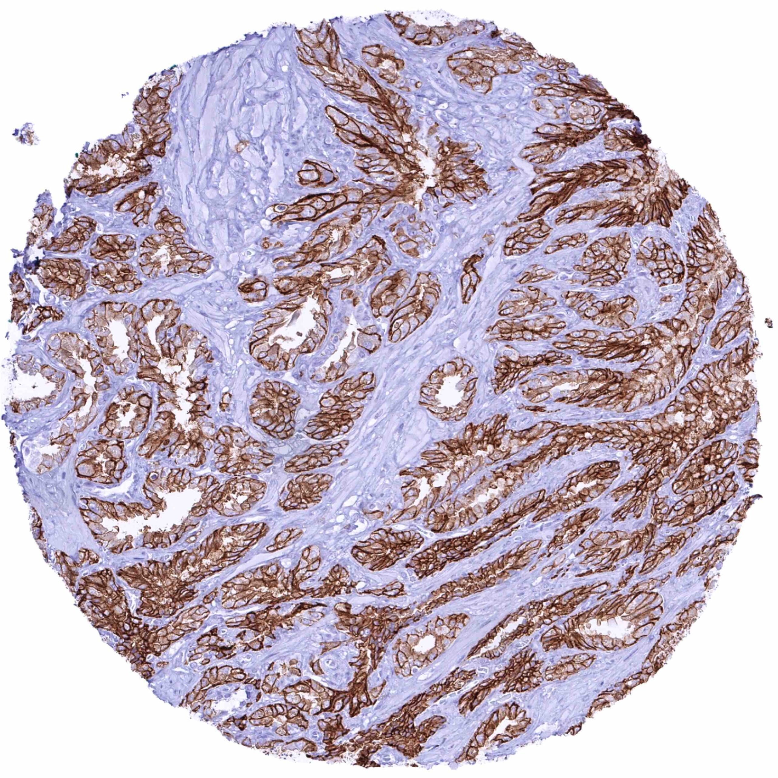 CD38 (MSVA-038R) - MS Validated Antibodies