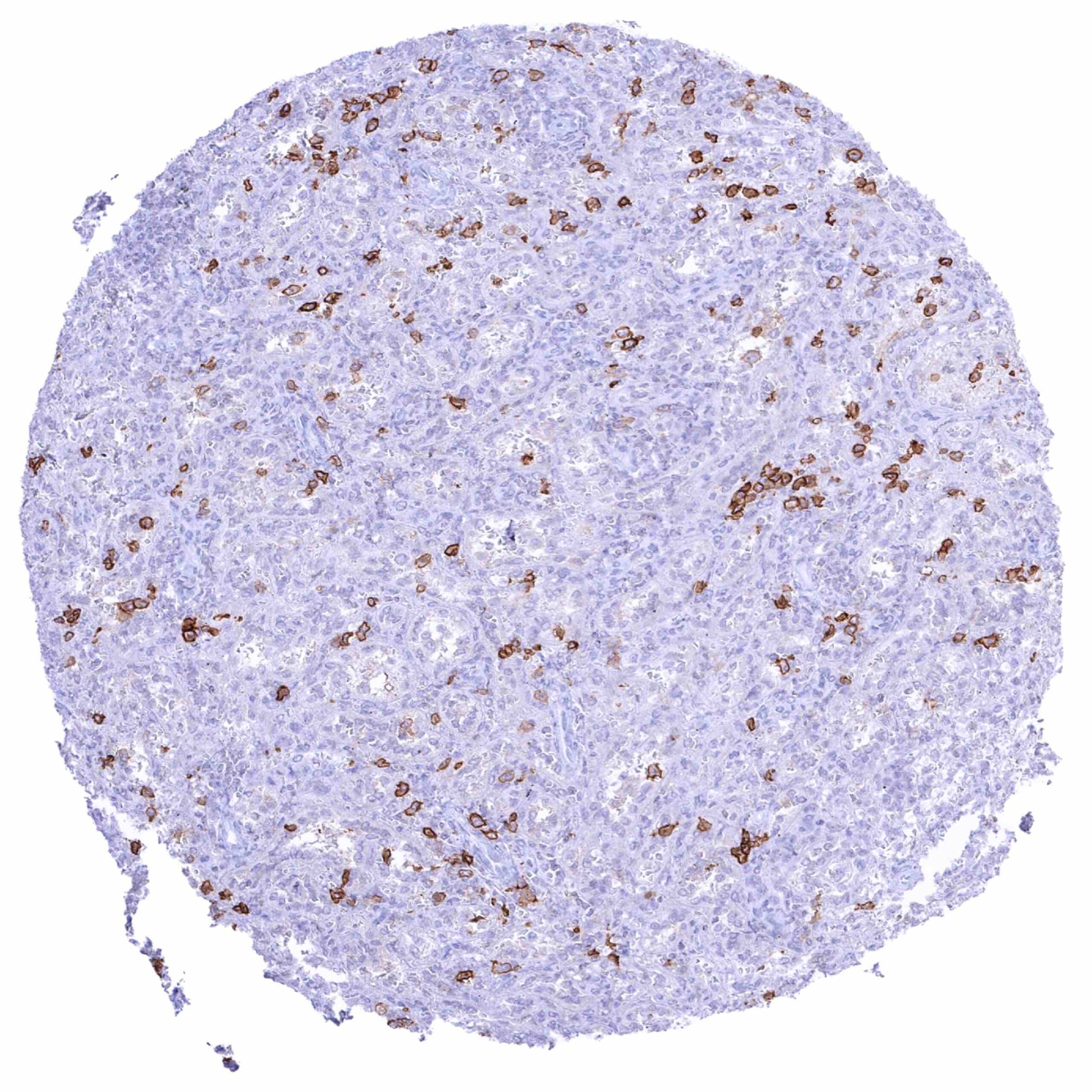 Normal Tissue Gallery CD38 - MS Validated Antibodies