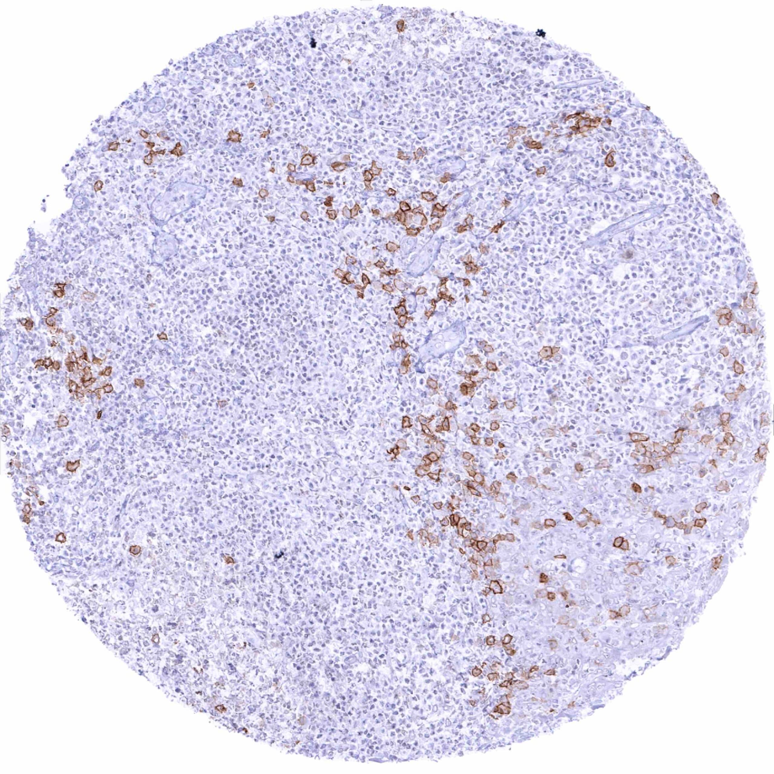 Normal Tissue Gallery CD38 - MS Validated Antibodies