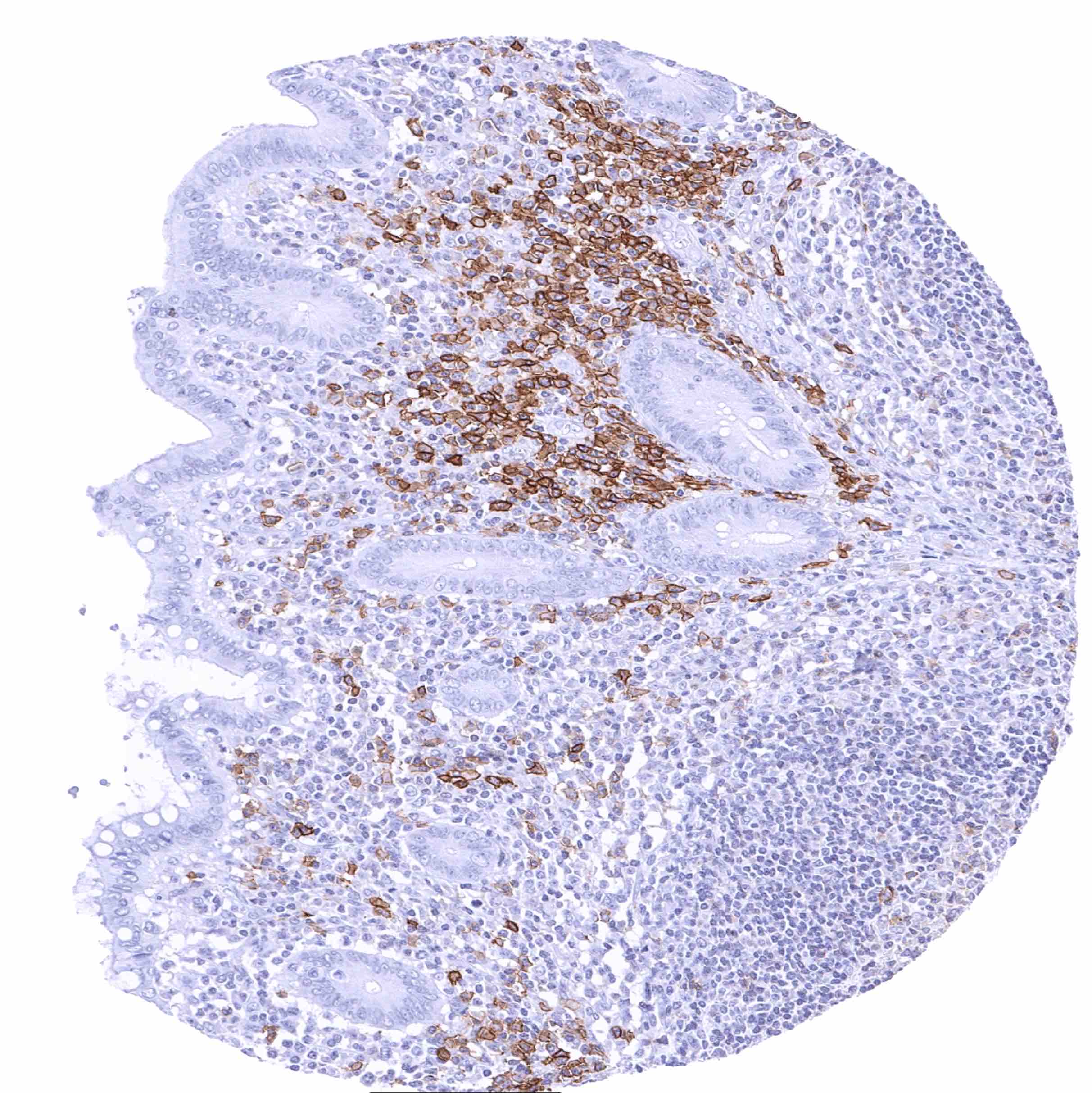 CD38 (MSVA-038R) - MS Validated Antibodies