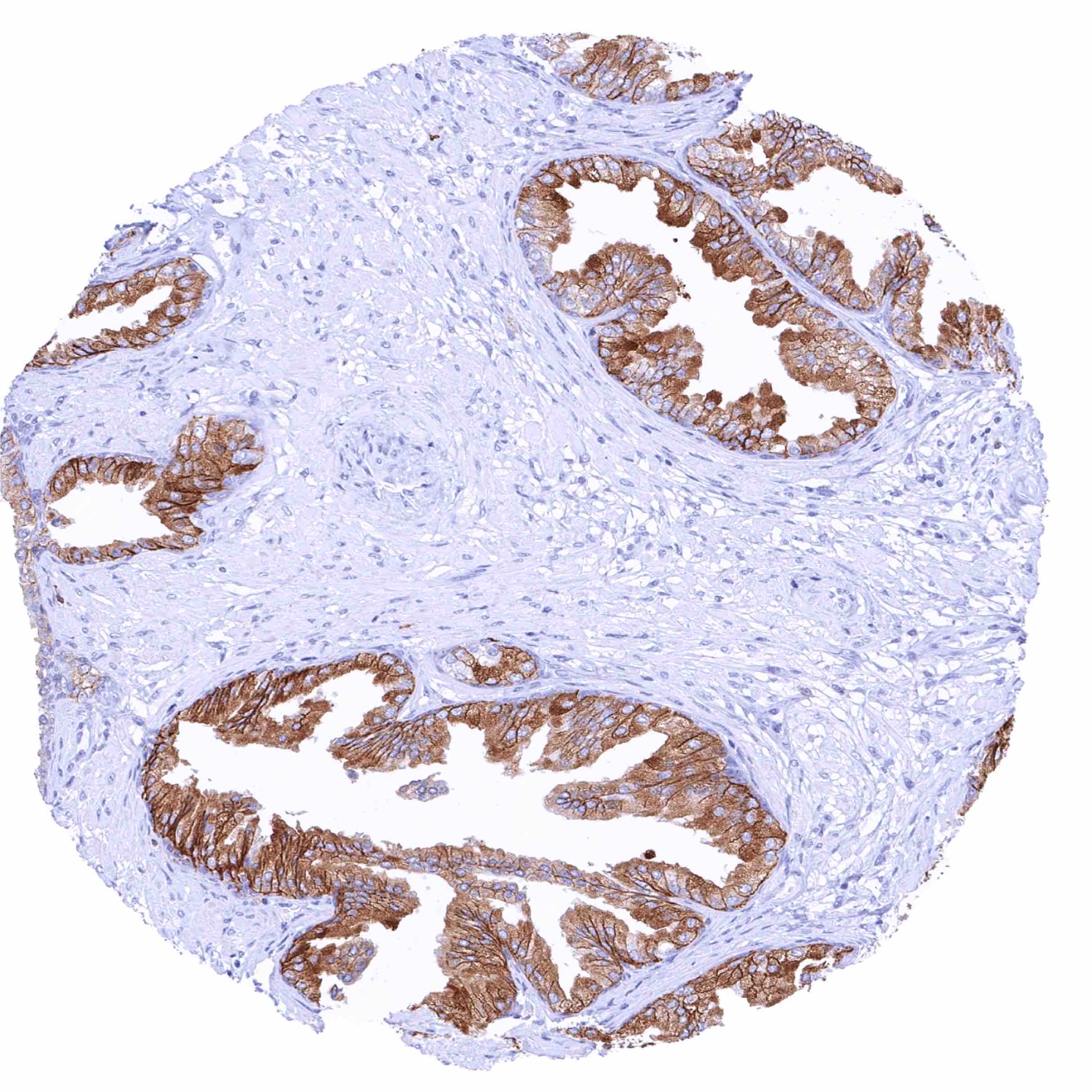 CD38 (MSVA-038R) - MS Validated Antibodies