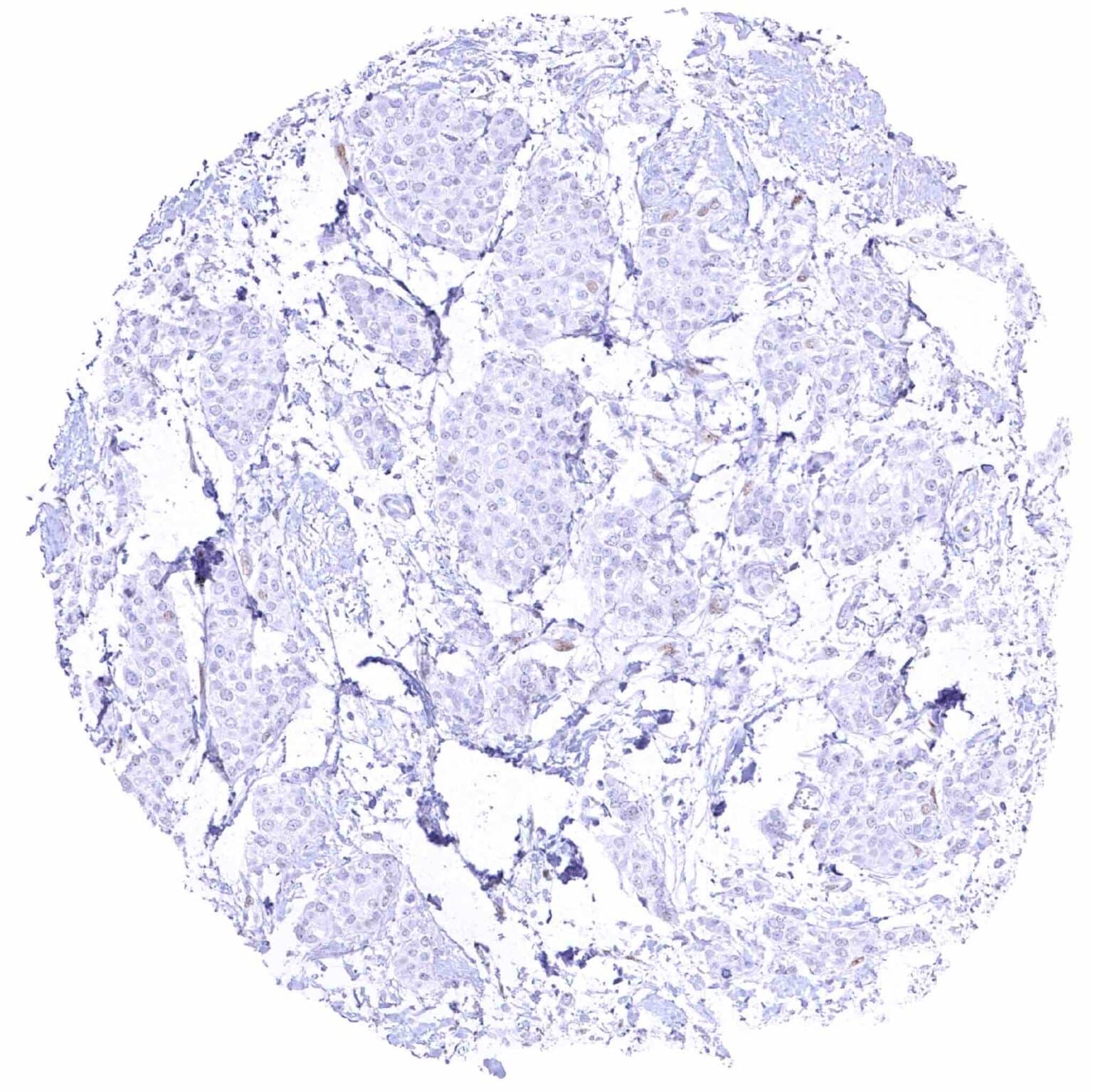 Cancer Tissue Gallery Cyclin E1 - MS Validated Antibodies