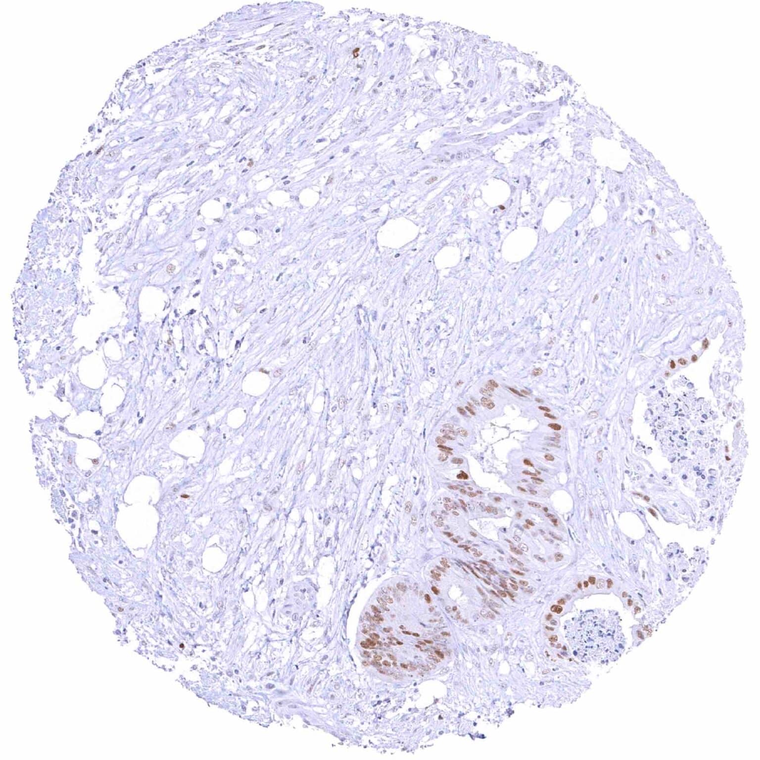 Cancer Tissue Gallery Cyclin E1 - MS Validated Antibodies