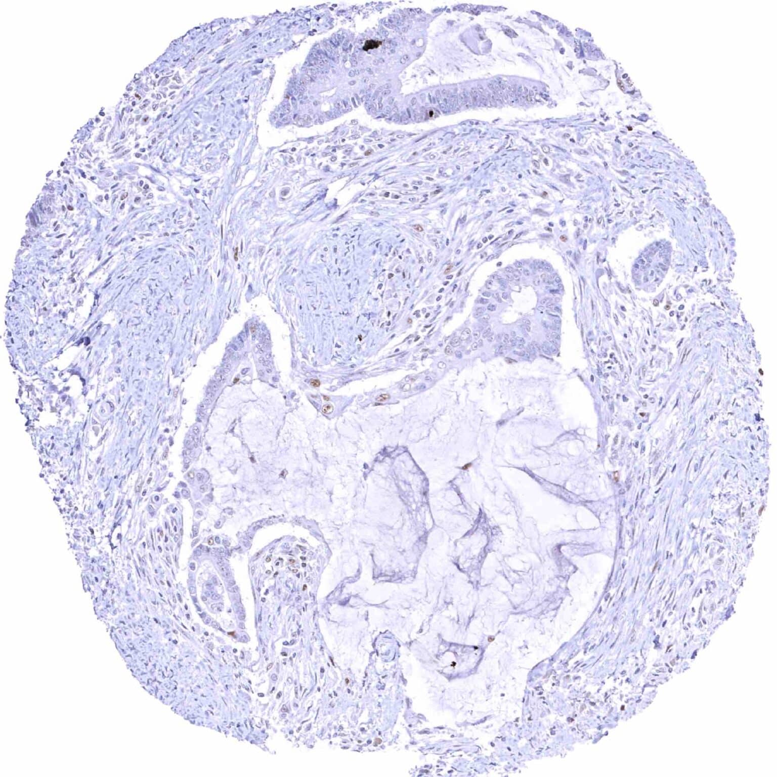 Cancer Tissue Gallery Cyclin E1 - MS Validated Antibodies