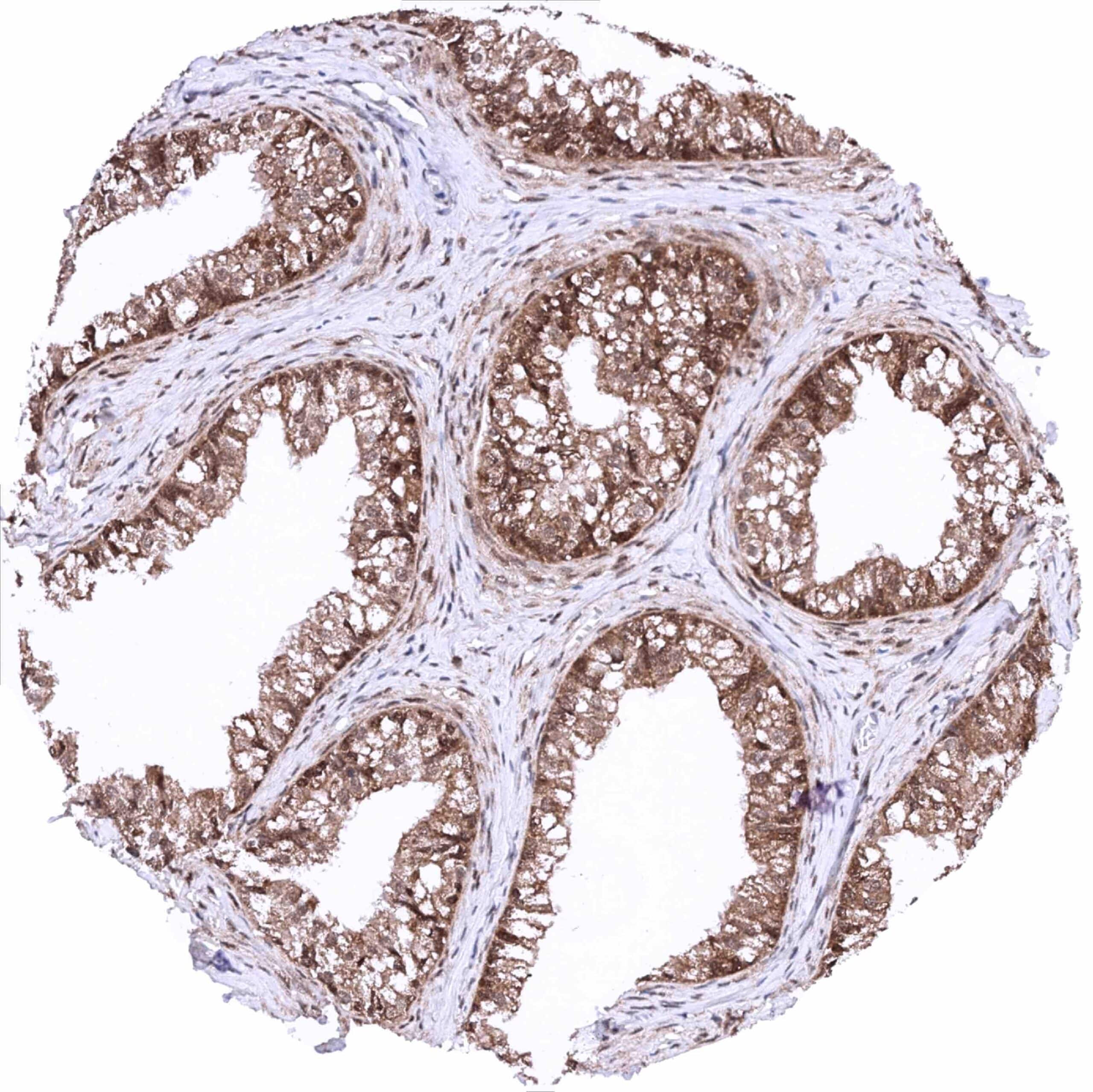 Normal Tissue Gallery MTAP - MS Validated Antibodies