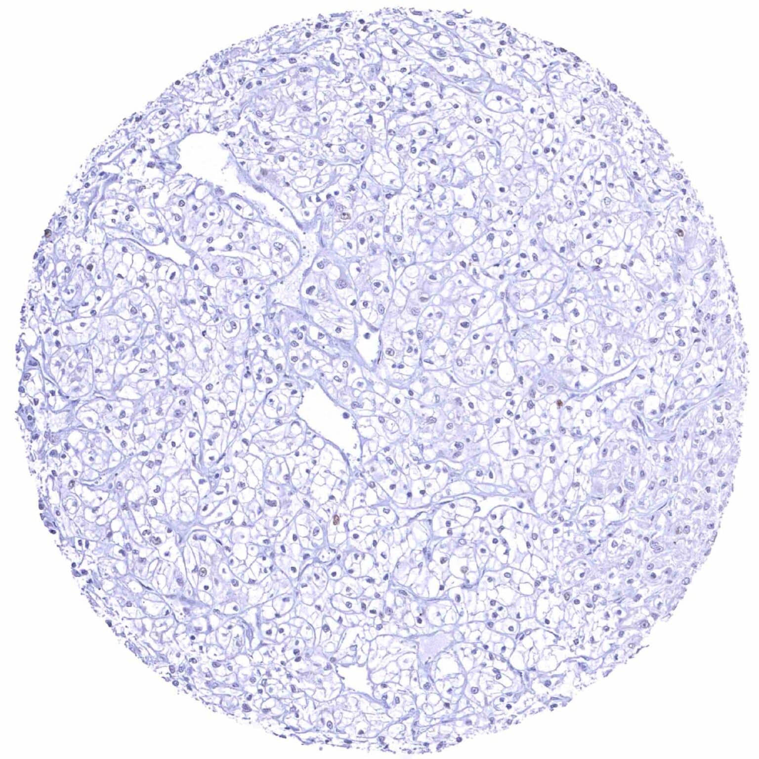 Cancer Tissue Gallery Cyclin E1 - MS Validated Antibodies