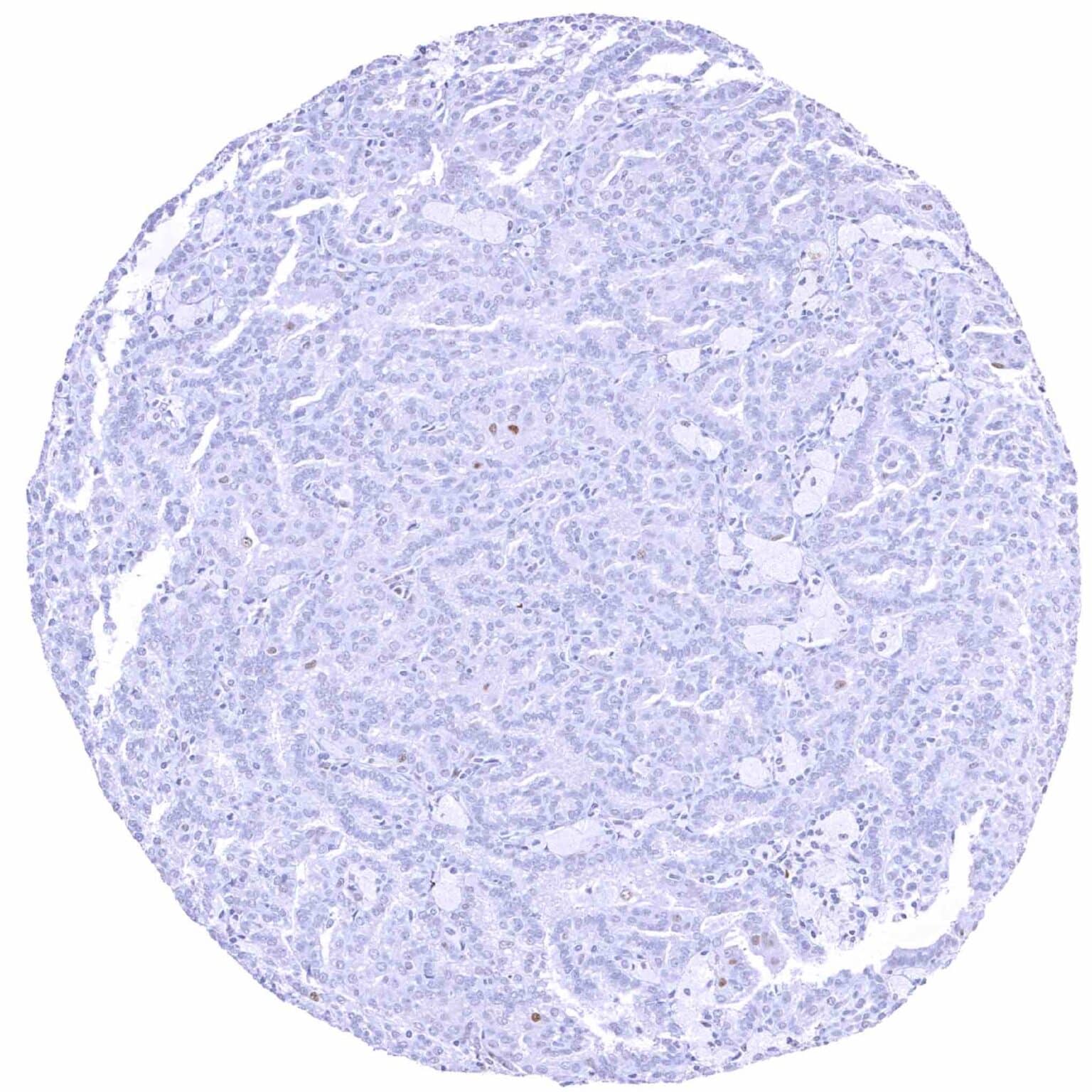 Cancer Tissue Gallery Cyclin E1 - MS Validated Antibodies