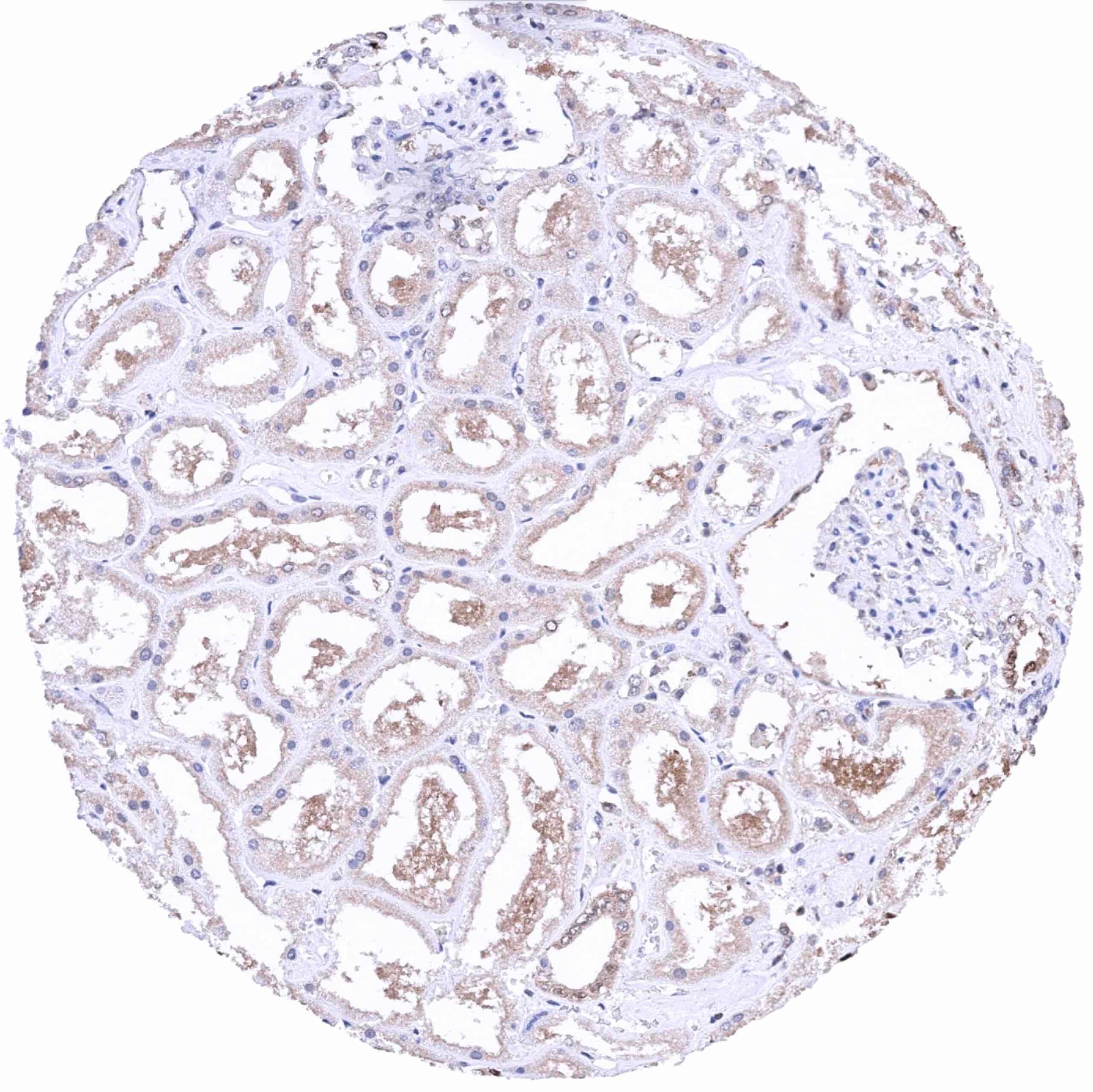 Normal Tissue Gallery MTAP - MS Validated Antibodies
