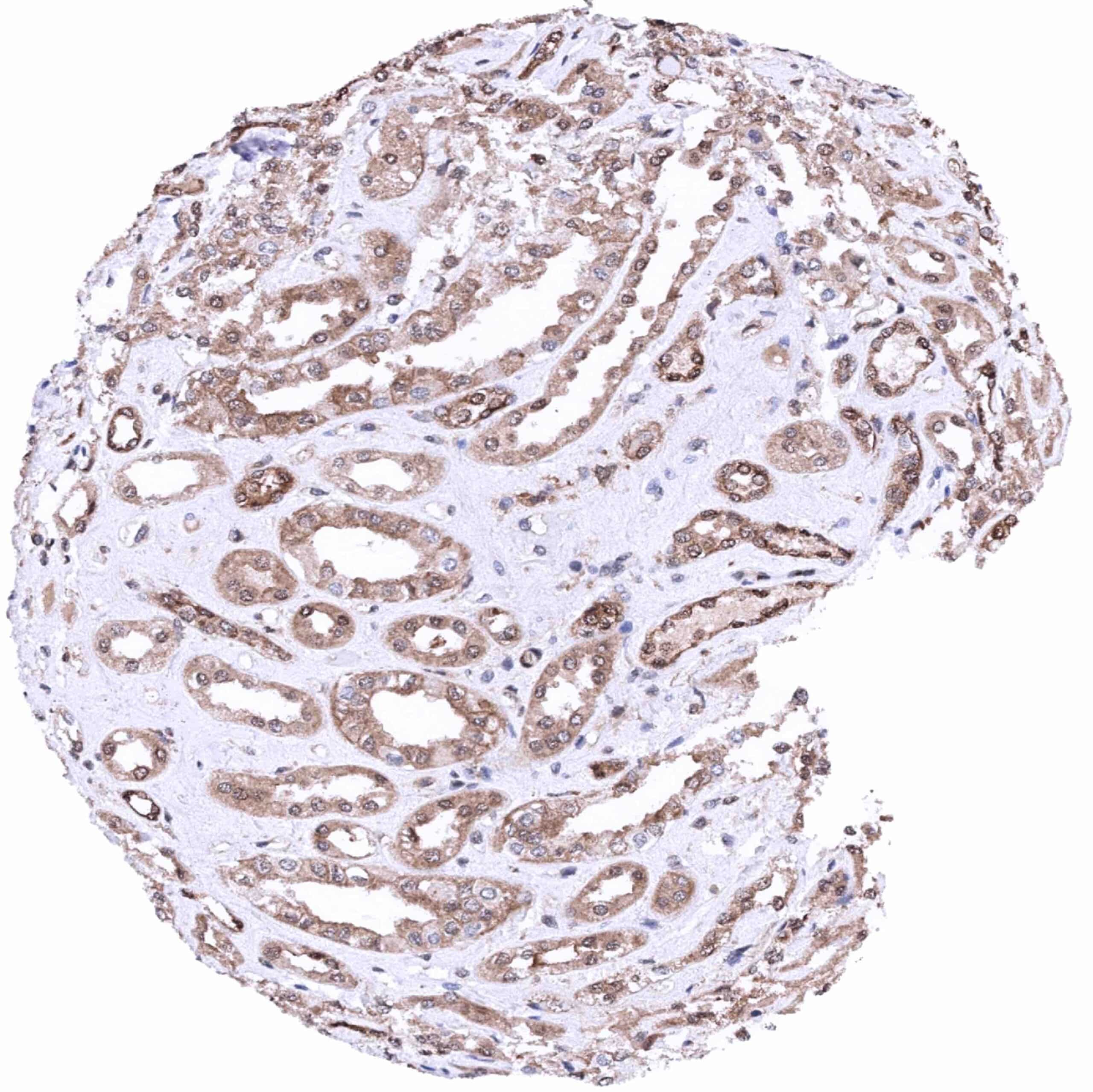 Normal Tissue Gallery MTAP - MS Validated Antibodies