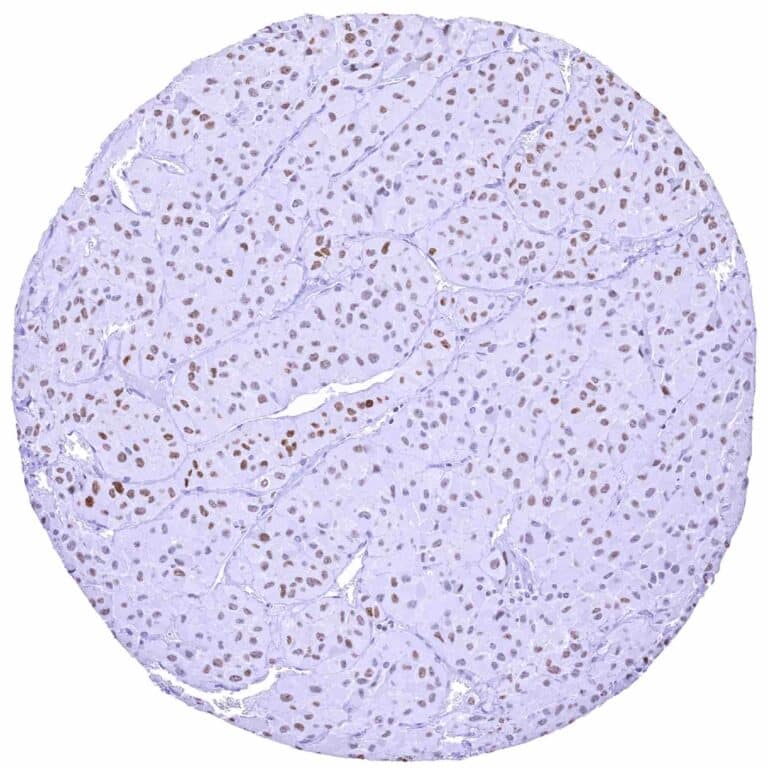 Cancer Tissue Gallery HMGA2 - MS Validated Antibodies