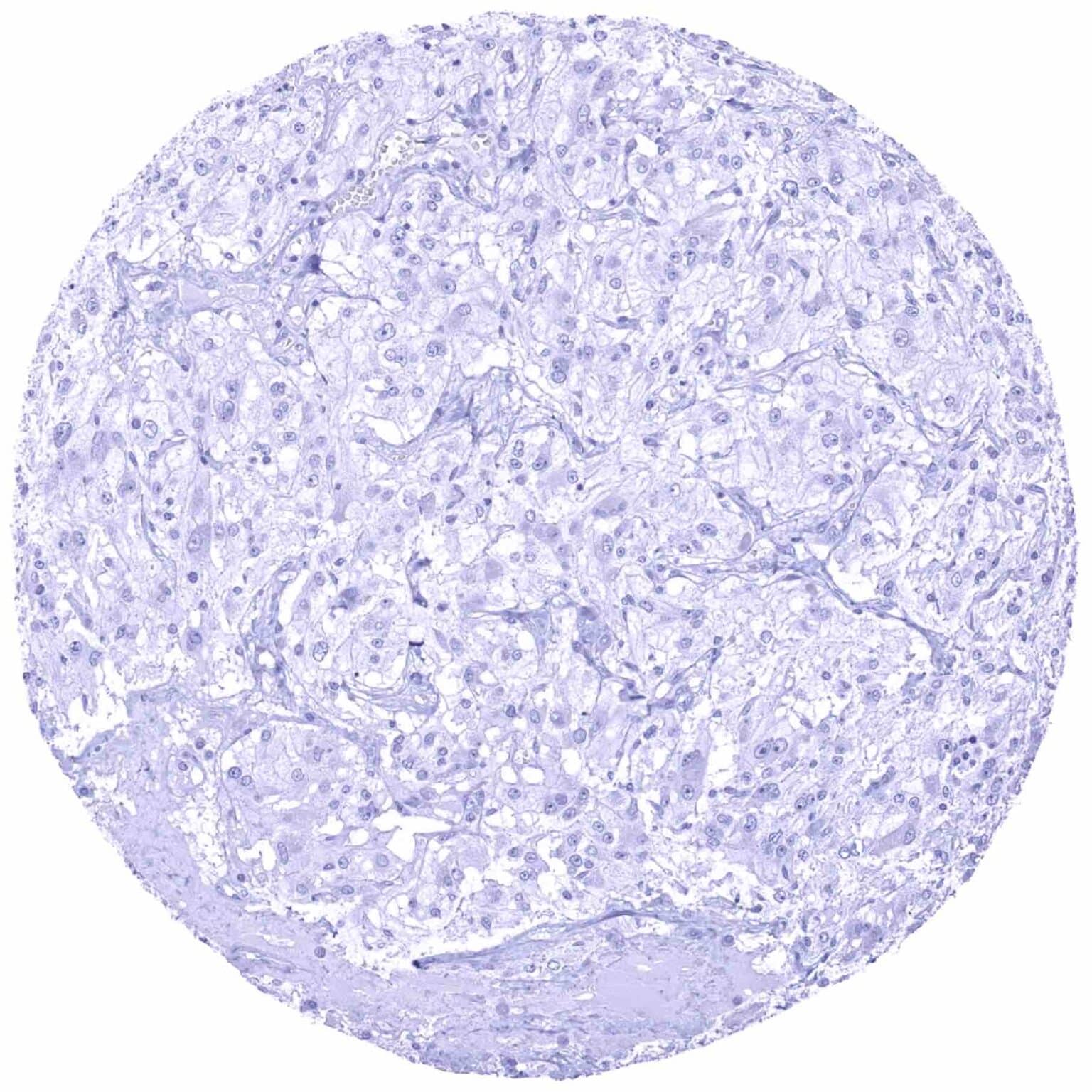 Cancer Tissue Gallery MUC2 - MS Validated Antibodies
