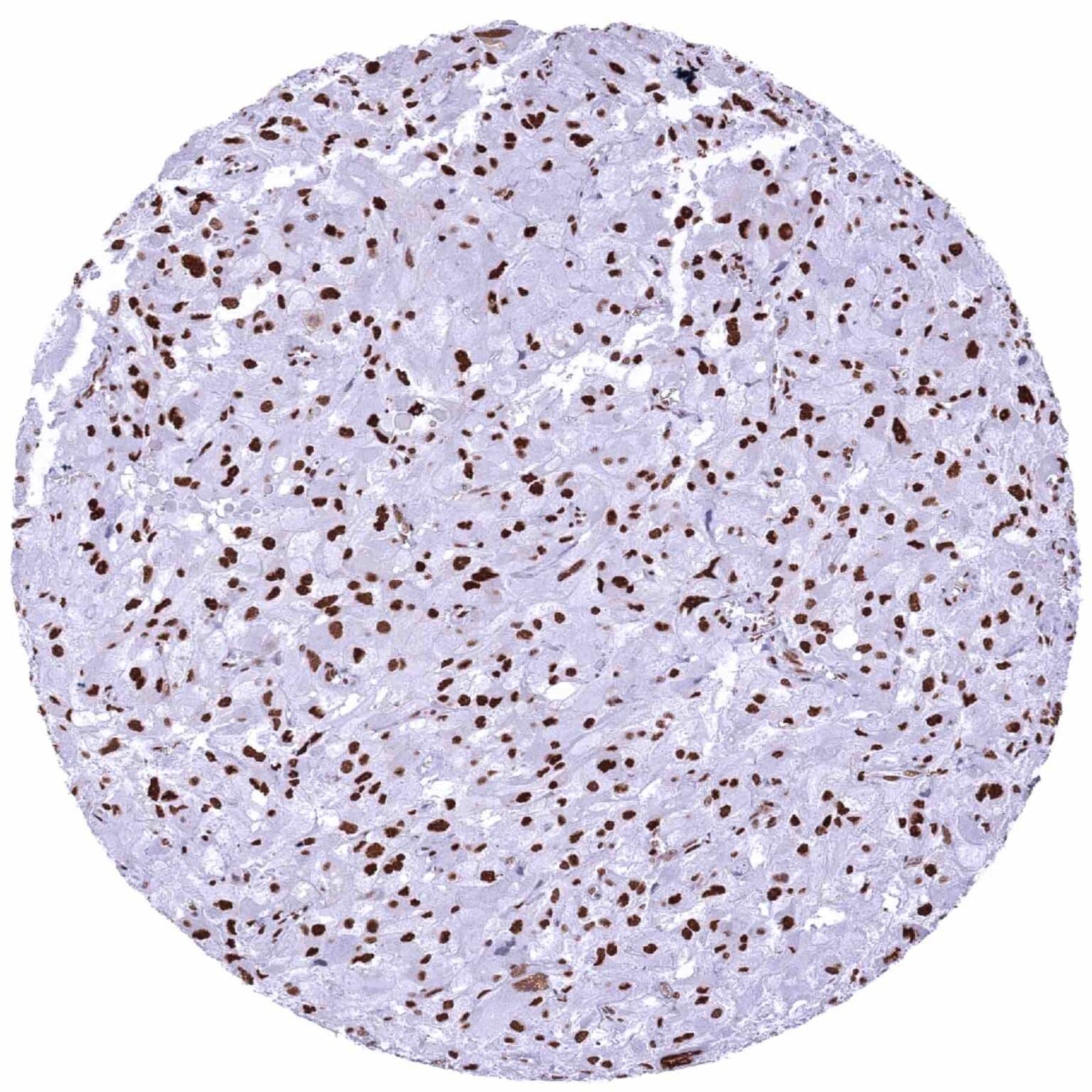 Cancer Tissue Gallery Glucocorticoid Receptor - MS Validated Antibodies