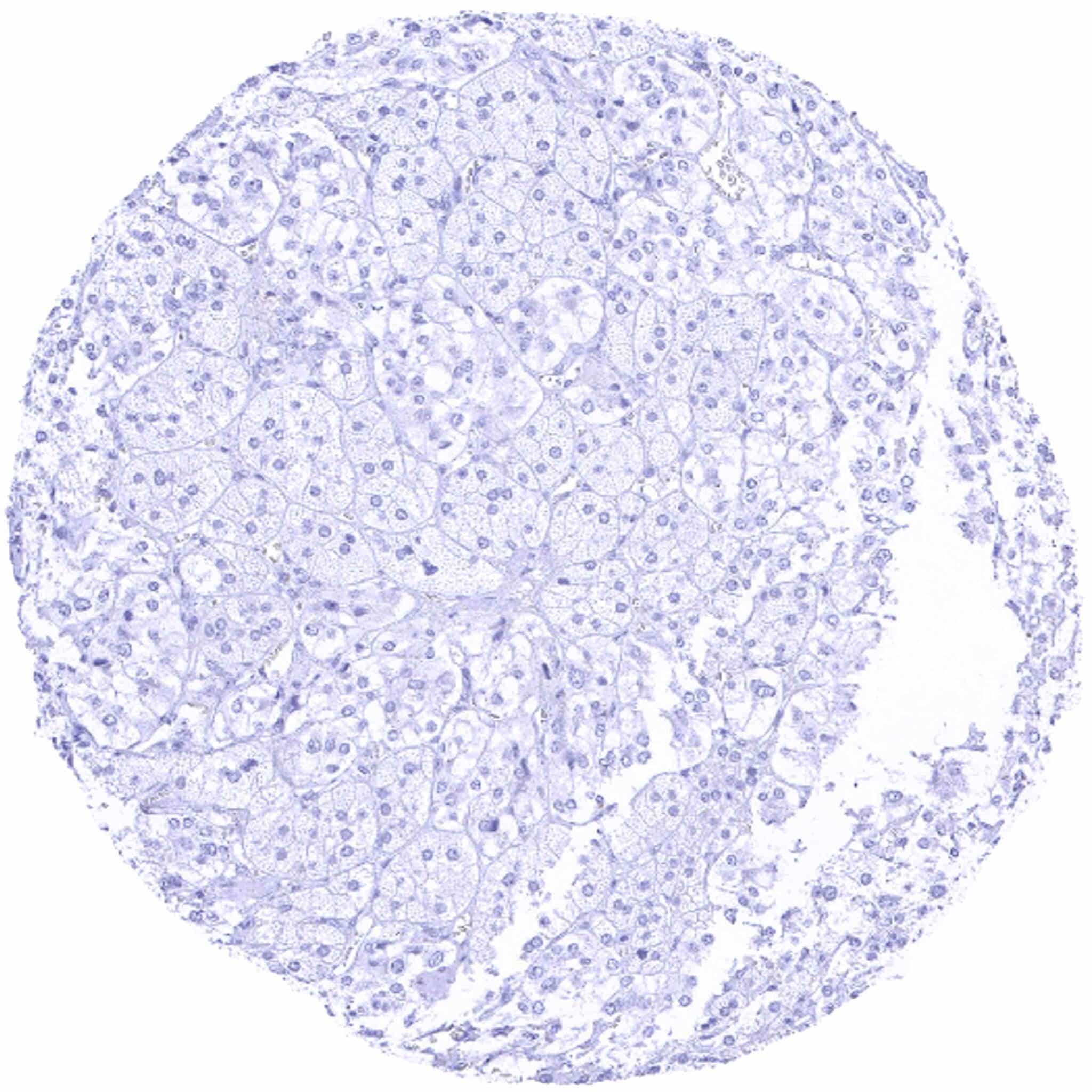 Normal Tissue Gallery MUC2 - MS Validated Antibodies