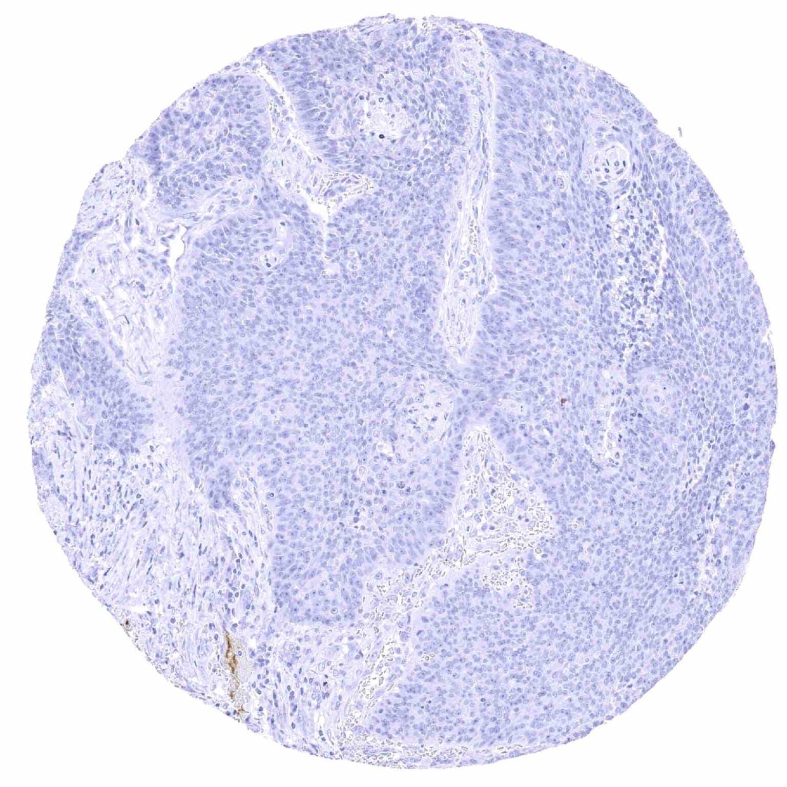 Cancer Tissue Gallery MUC2 - MS Validated Antibodies
