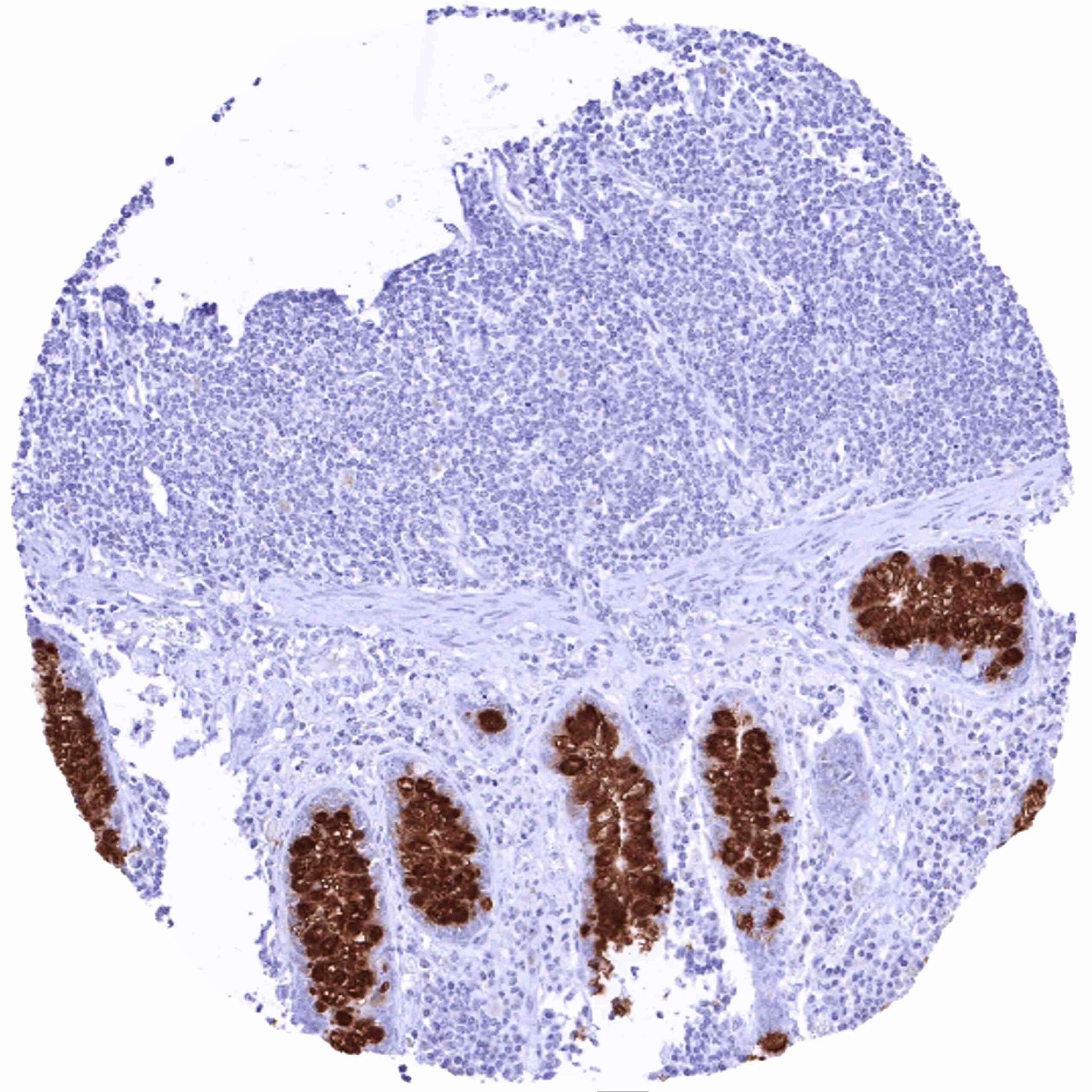 Normal Tissue Gallery MUC2 - MS Validated Antibodies