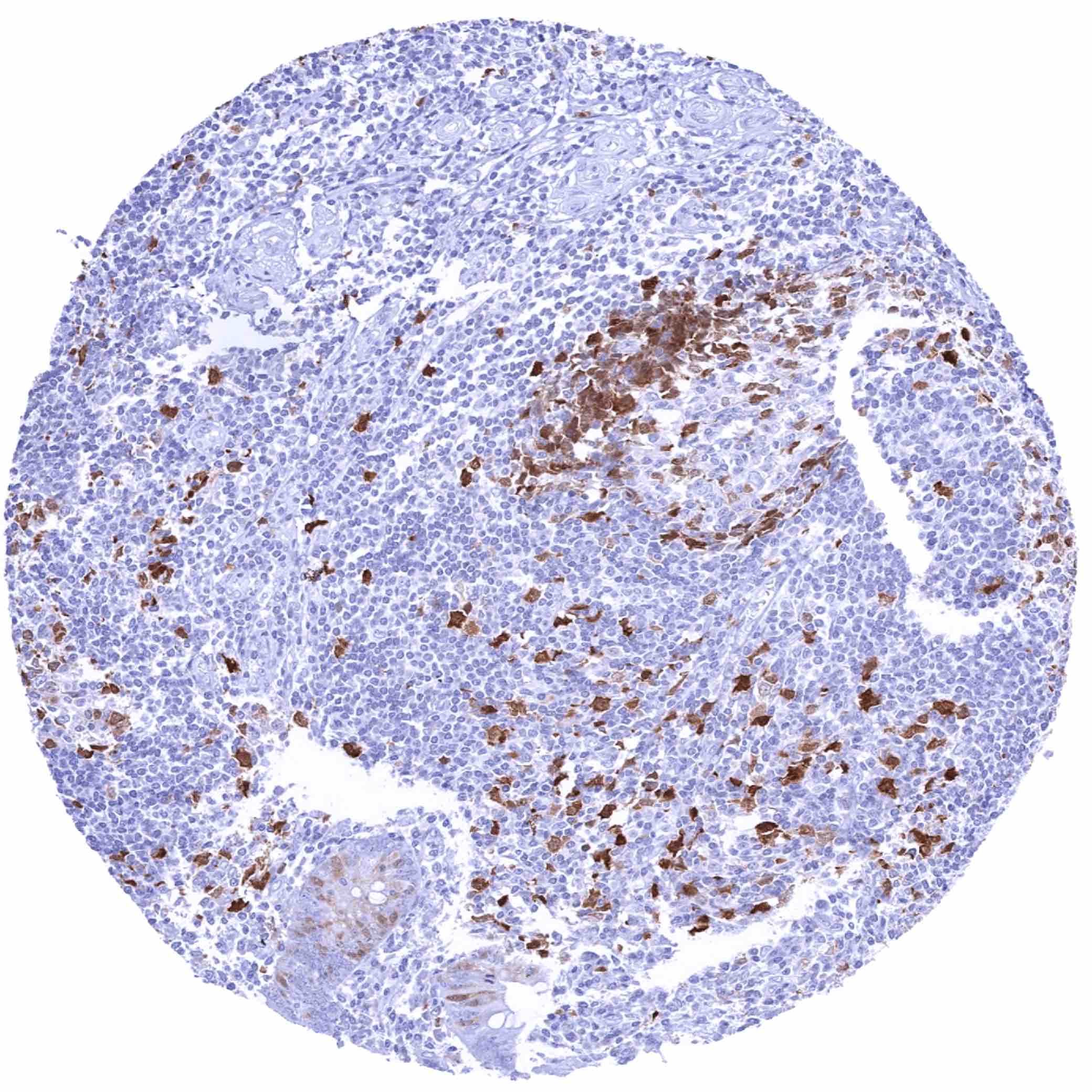 Normal Tissue Gallery TYMS - MS Validated Antibodies