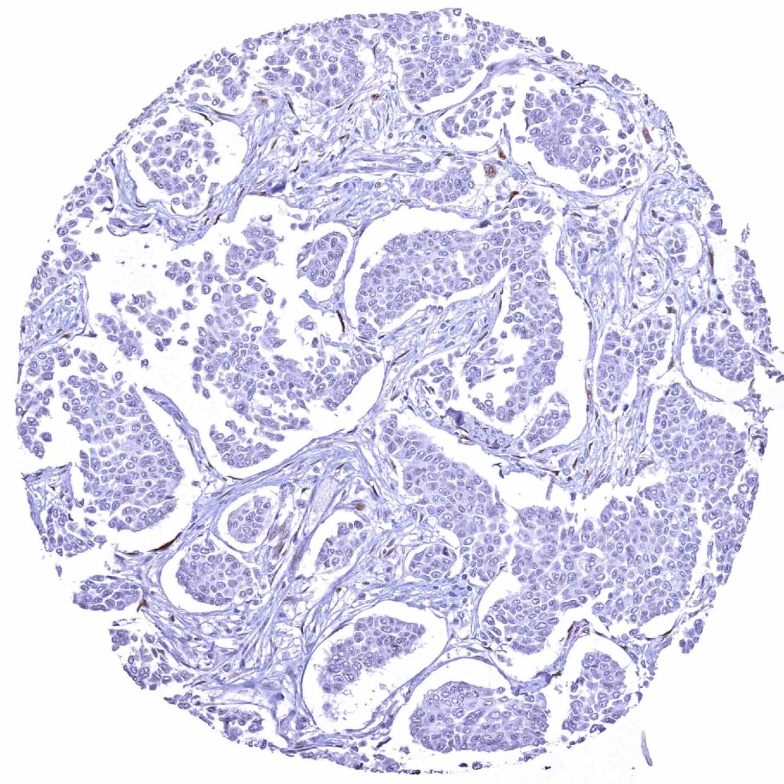 Cancer Tissue Gallery HMGA2 - MS Validated Antibodies