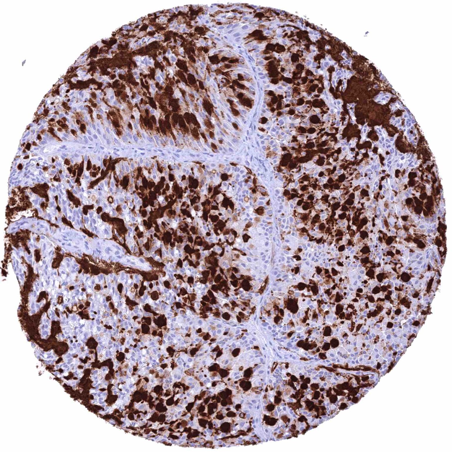 Cancer Tissue Gallery MUC2 - MS Validated Antibodies