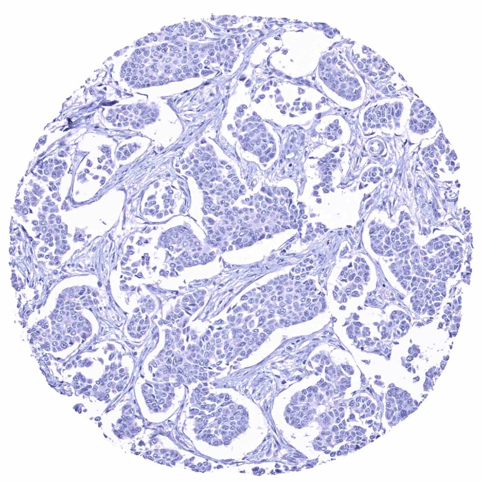 Cancer Tissue Gallery MUC2 - MS Validated Antibodies