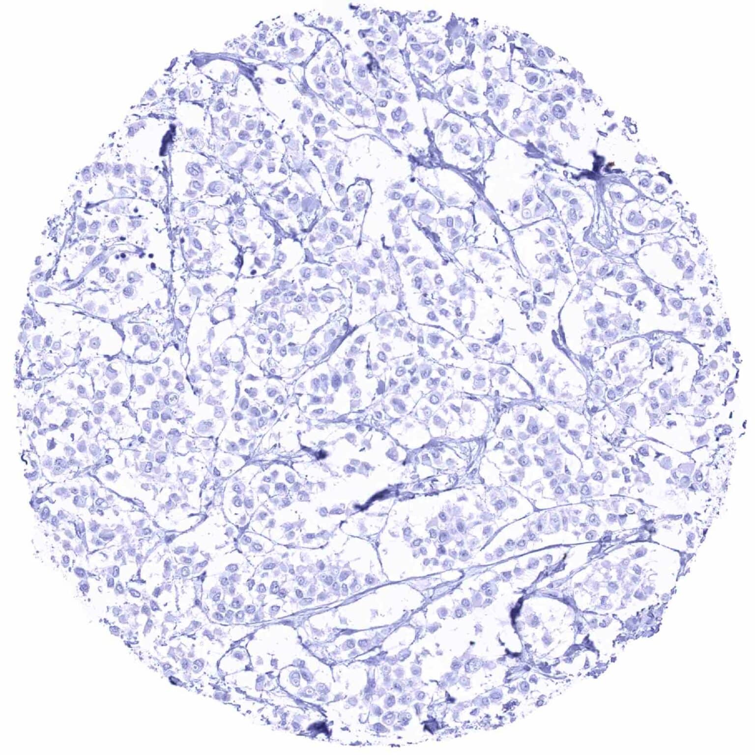 Cancer Tissue Gallery MUC2 - MS Validated Antibodies