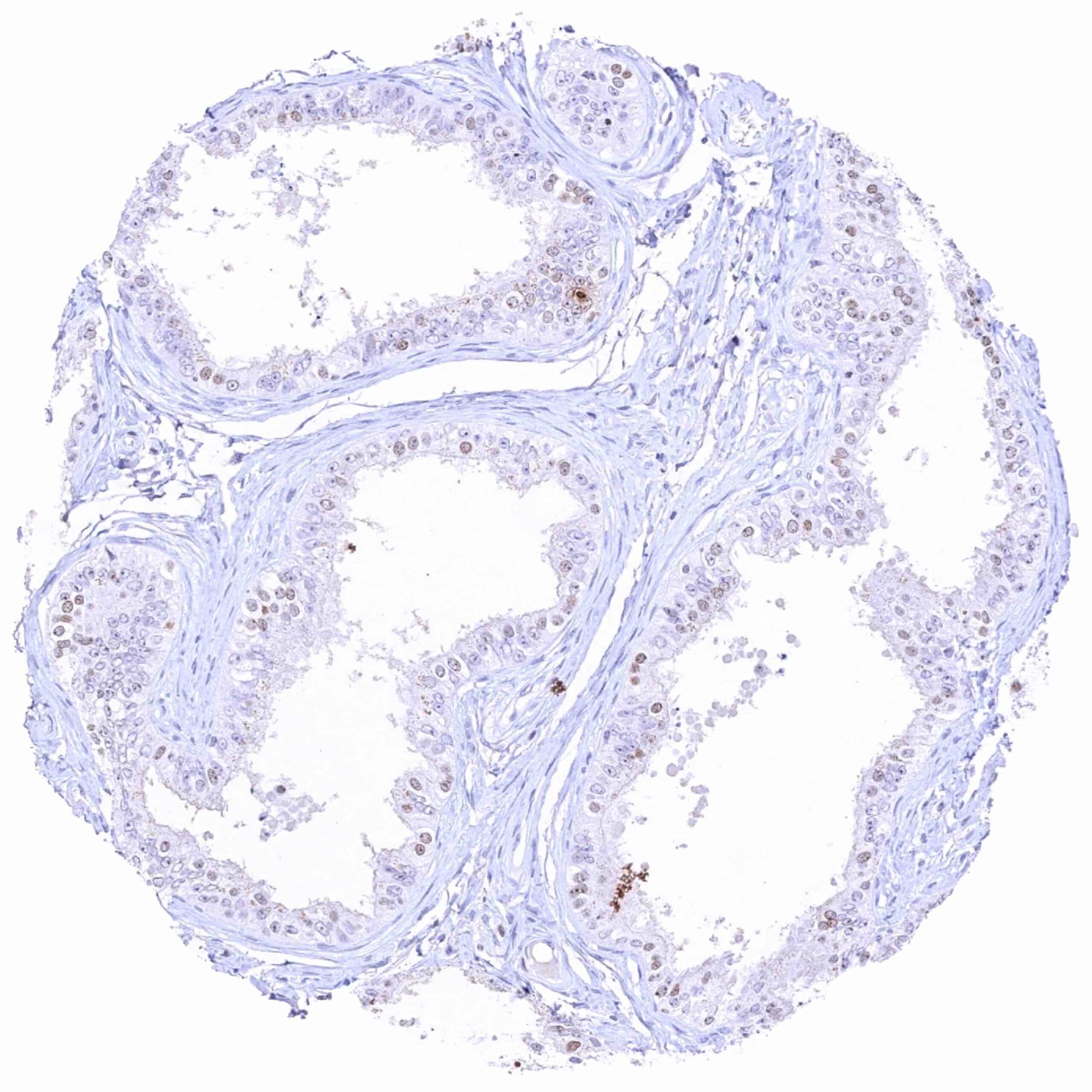 Normal Tissue Gallery HMGA2 - MS Validated Antibodies