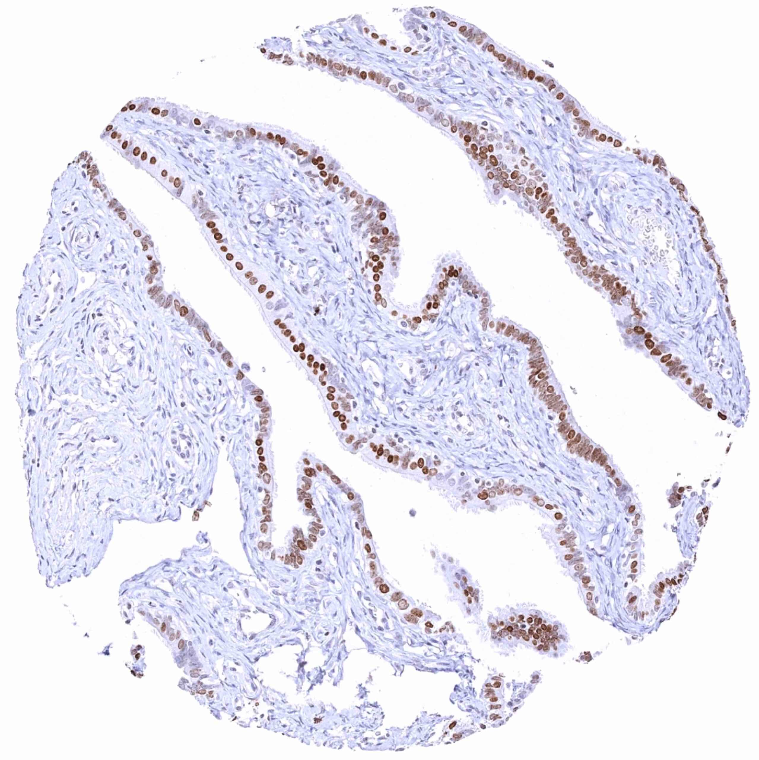 Normal Tissue Gallery HMGA2 - MS Validated Antibodies