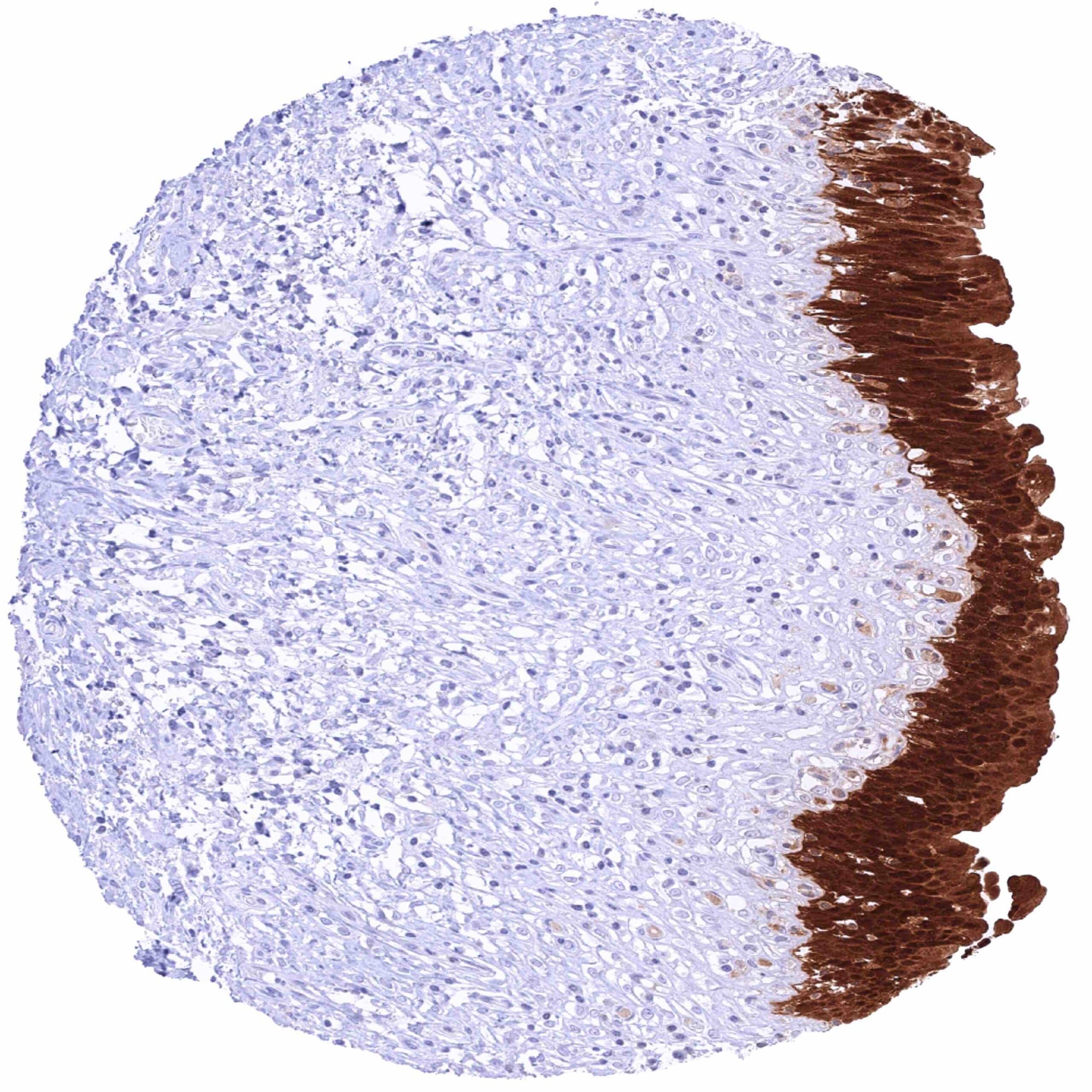 GPX2 (HMV301) - MS Validated Antibodies