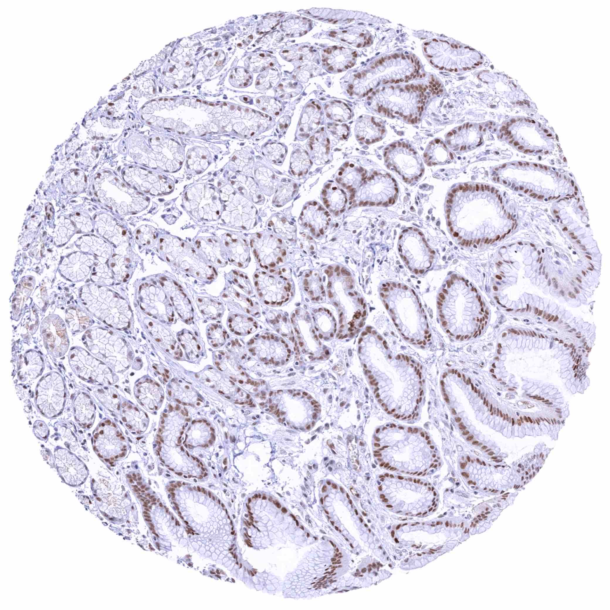 Normal Tissue Gallery KDM6A - MS Validated Antibodies
