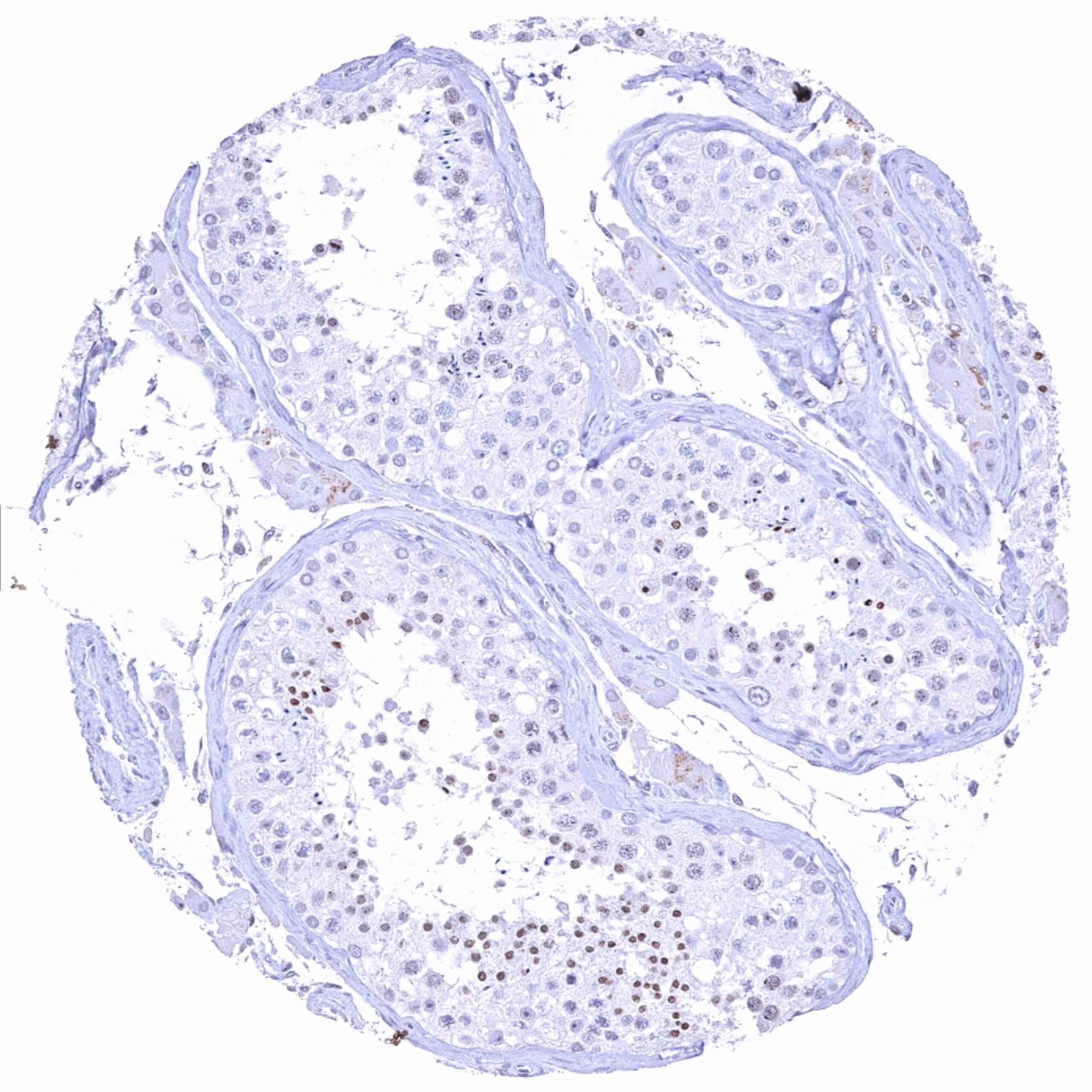 Normal Tissue Gallery HMGA2 - MS Validated Antibodies