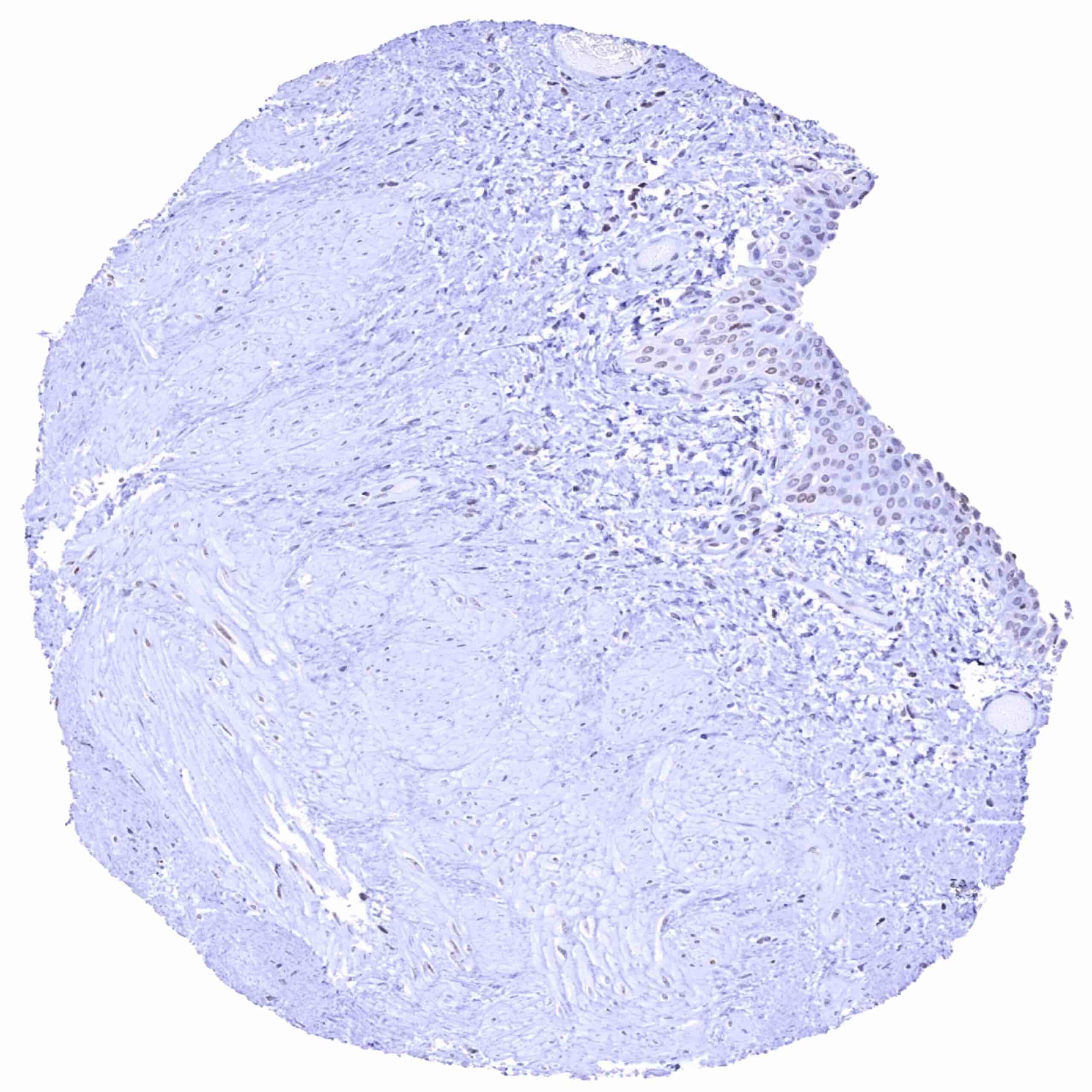 Normal Tissue Gallery HMGA2 - MS Validated Antibodies