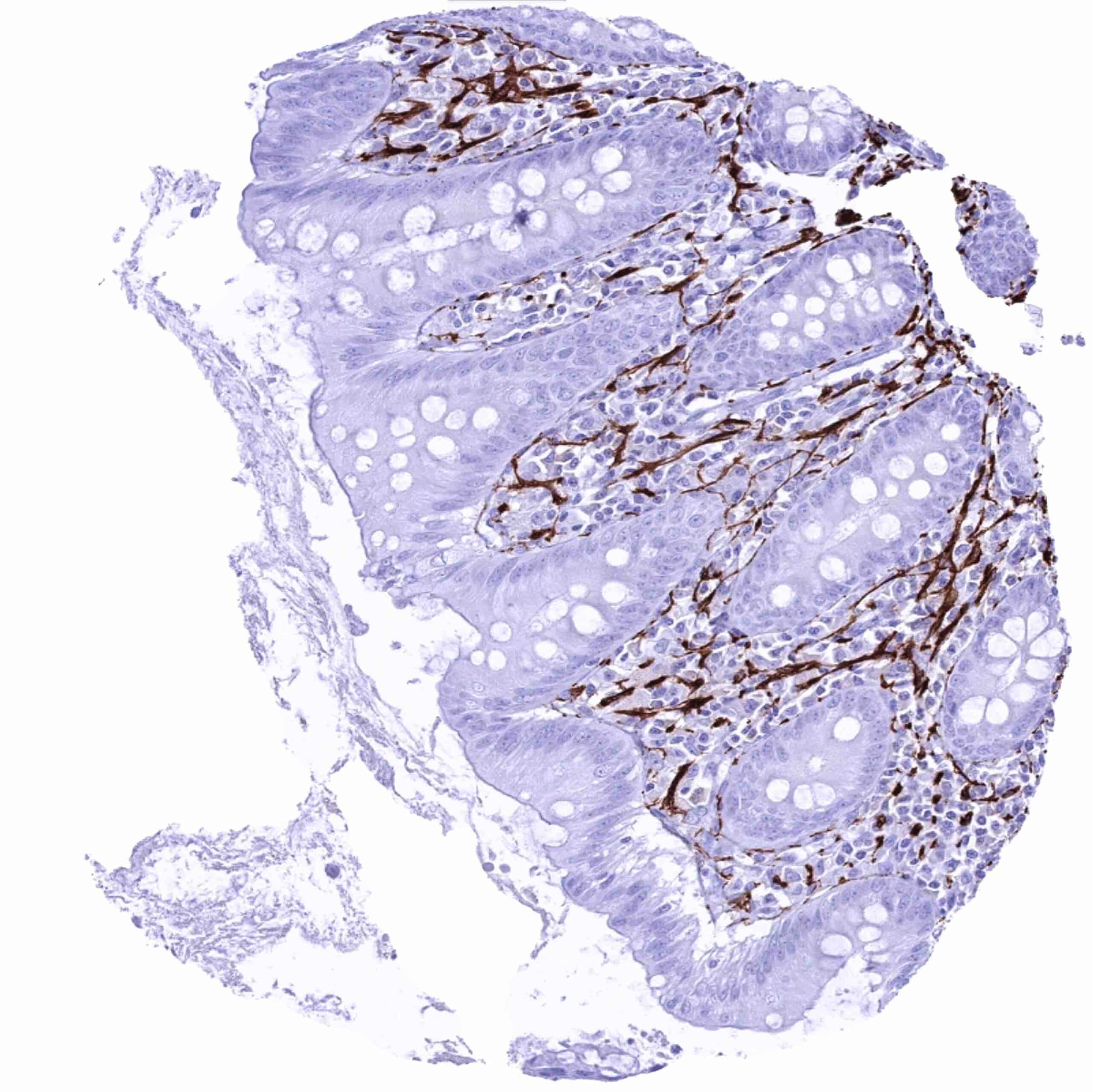 Normal Tissue Gallery CD171 - MS Validated Antibodies