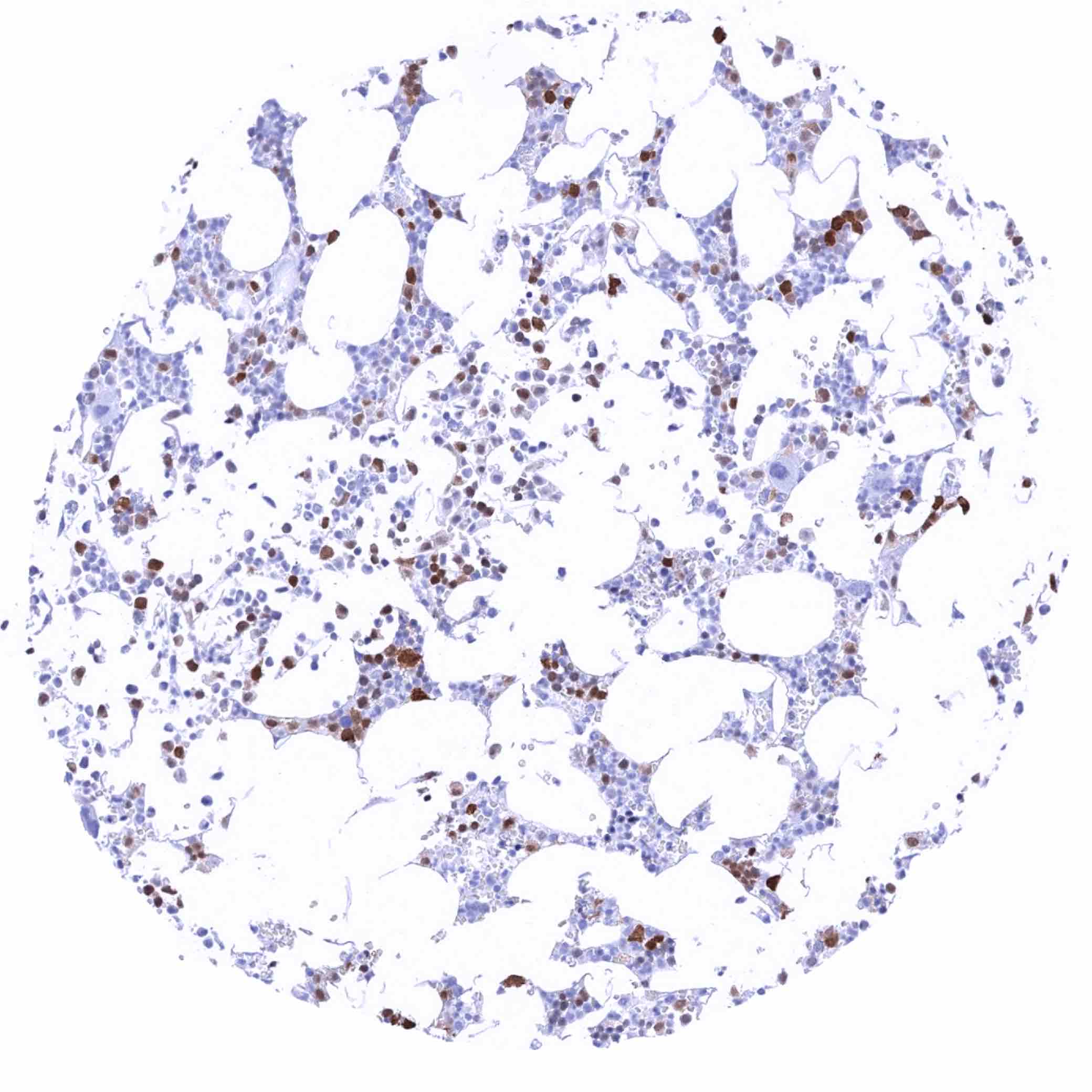 TYMS (HMV305) - MS Validated Antibodies