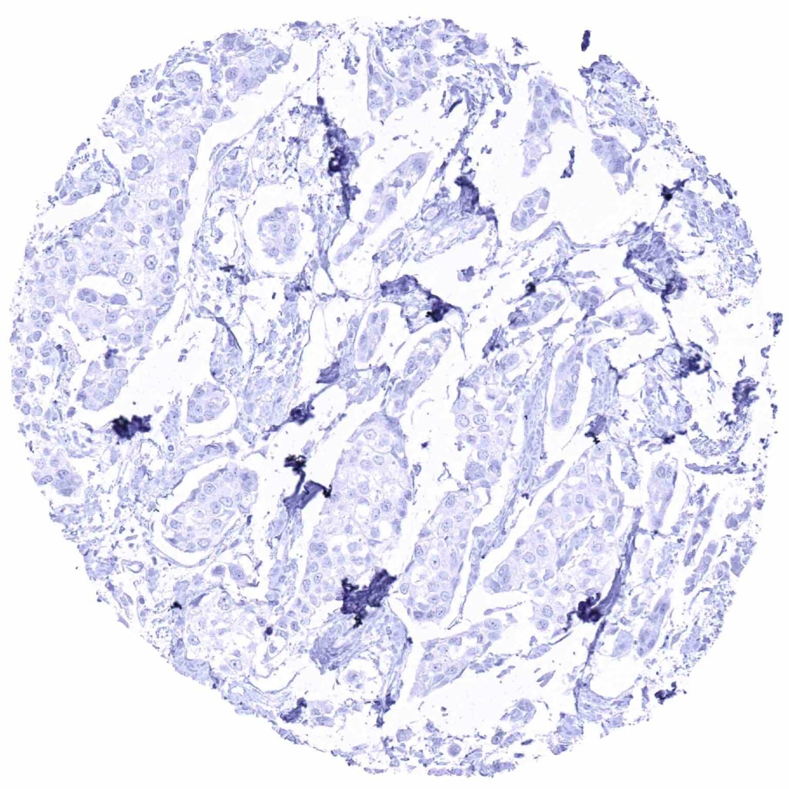 Cancer Tissue Gallery CD171 - MS Validated Antibodies