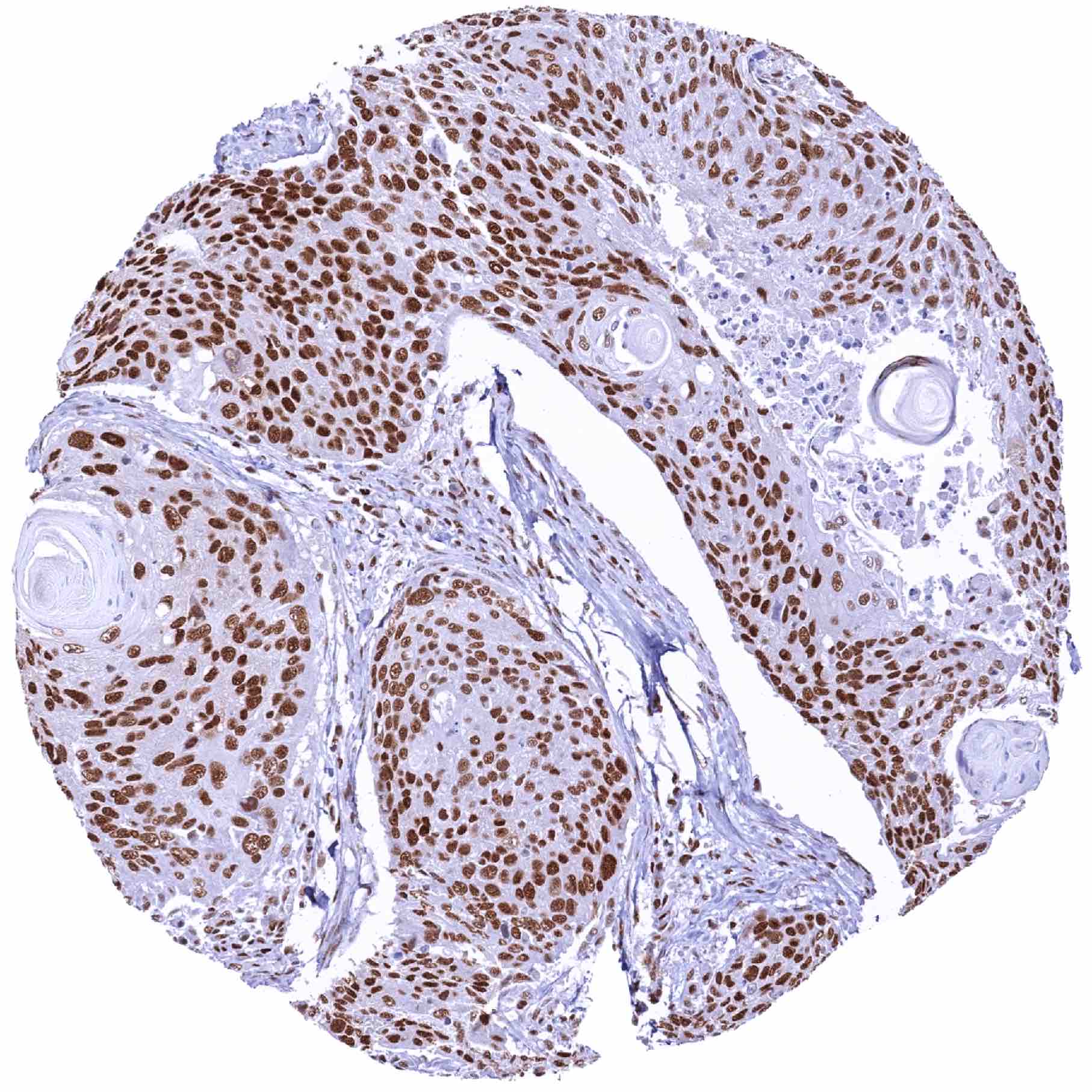 Glucocorticoid Receptor (HMV304) - MS Validated Antibodies