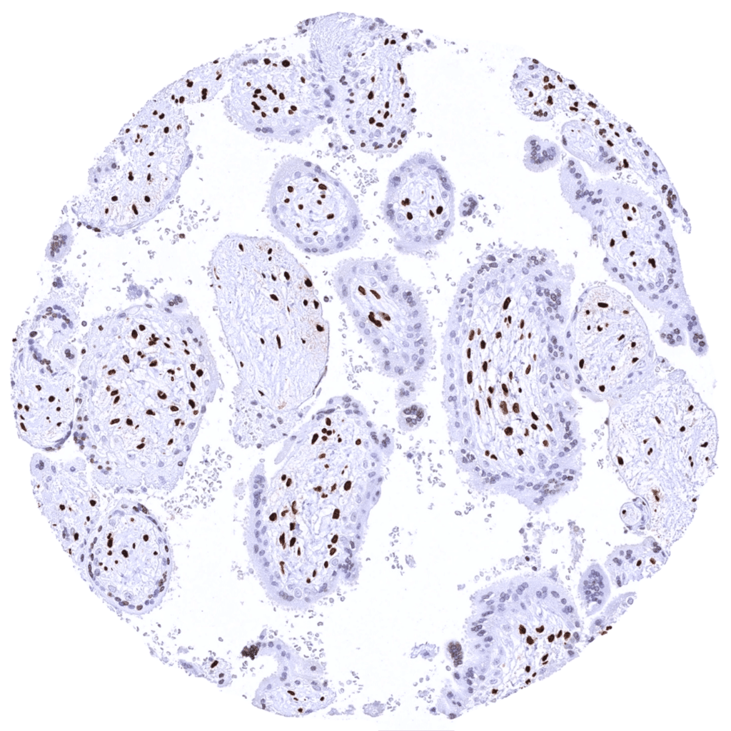 HMGA2 (HMV314) - MS Validated Antibodies