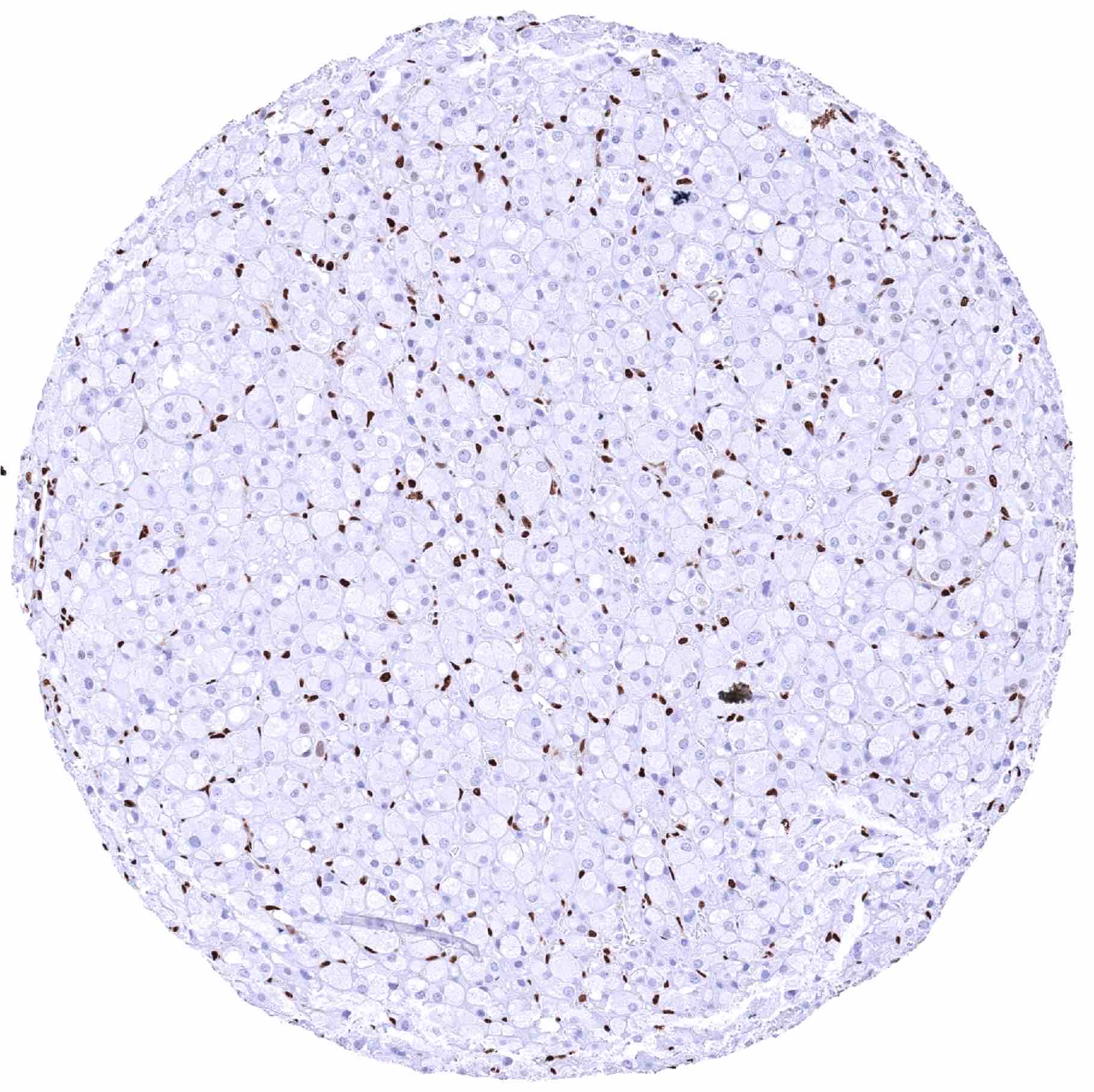 Glucocorticoid Receptor (HMV304) - MS Validated Antibodies