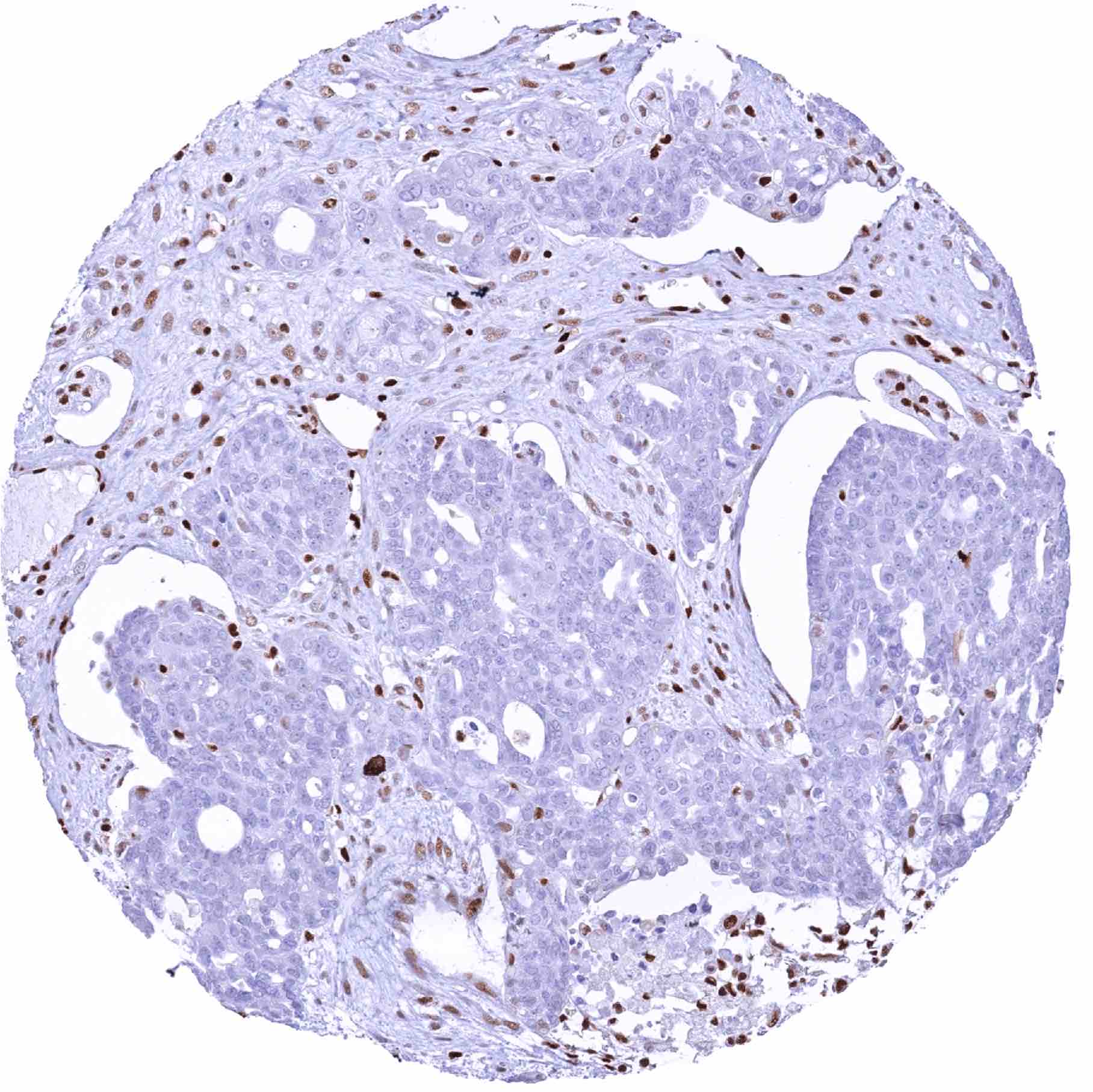 Glucocorticoid Receptor (HMV304) - MS Validated Antibodies