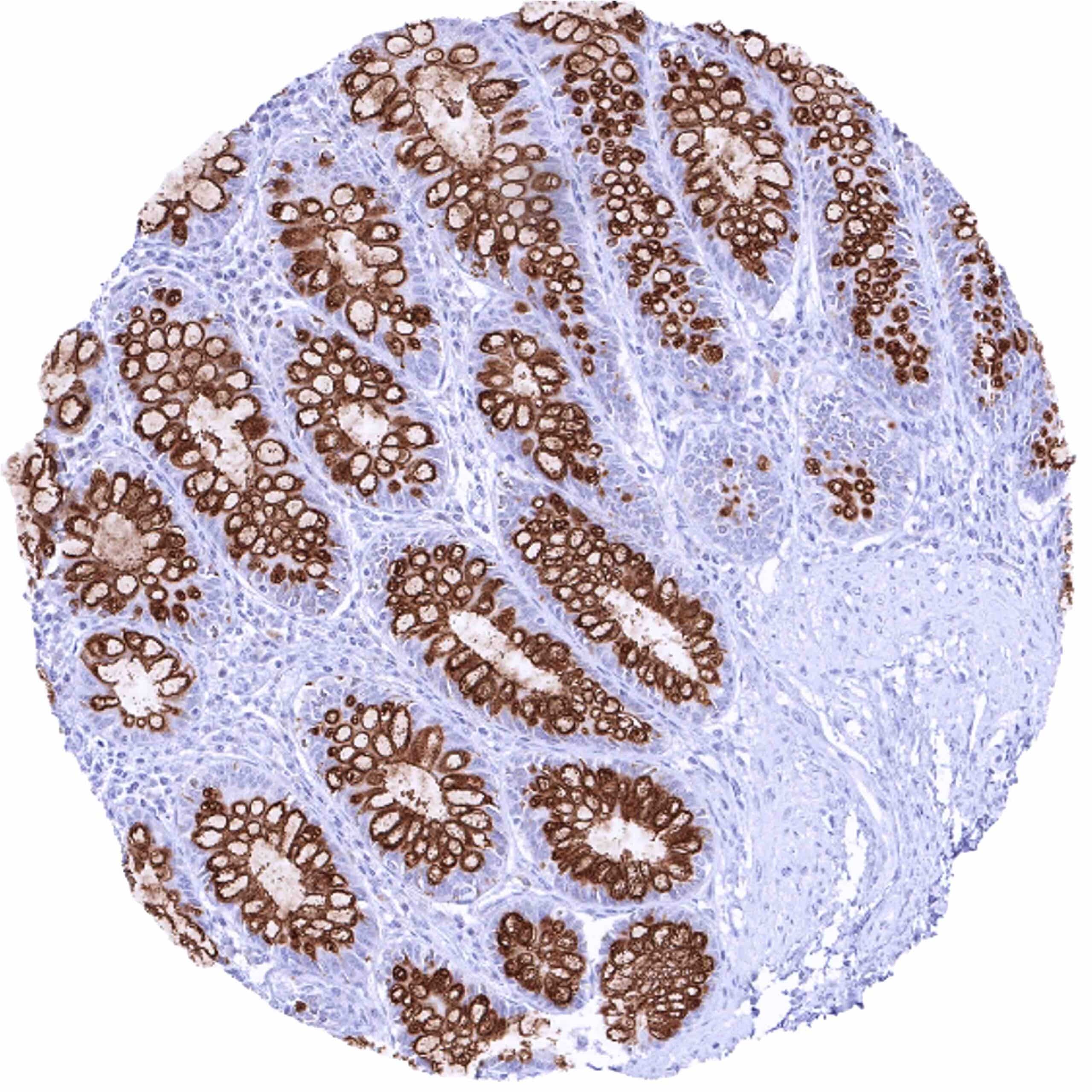 MUC2 (HMV310) - MS Validated Antibodies