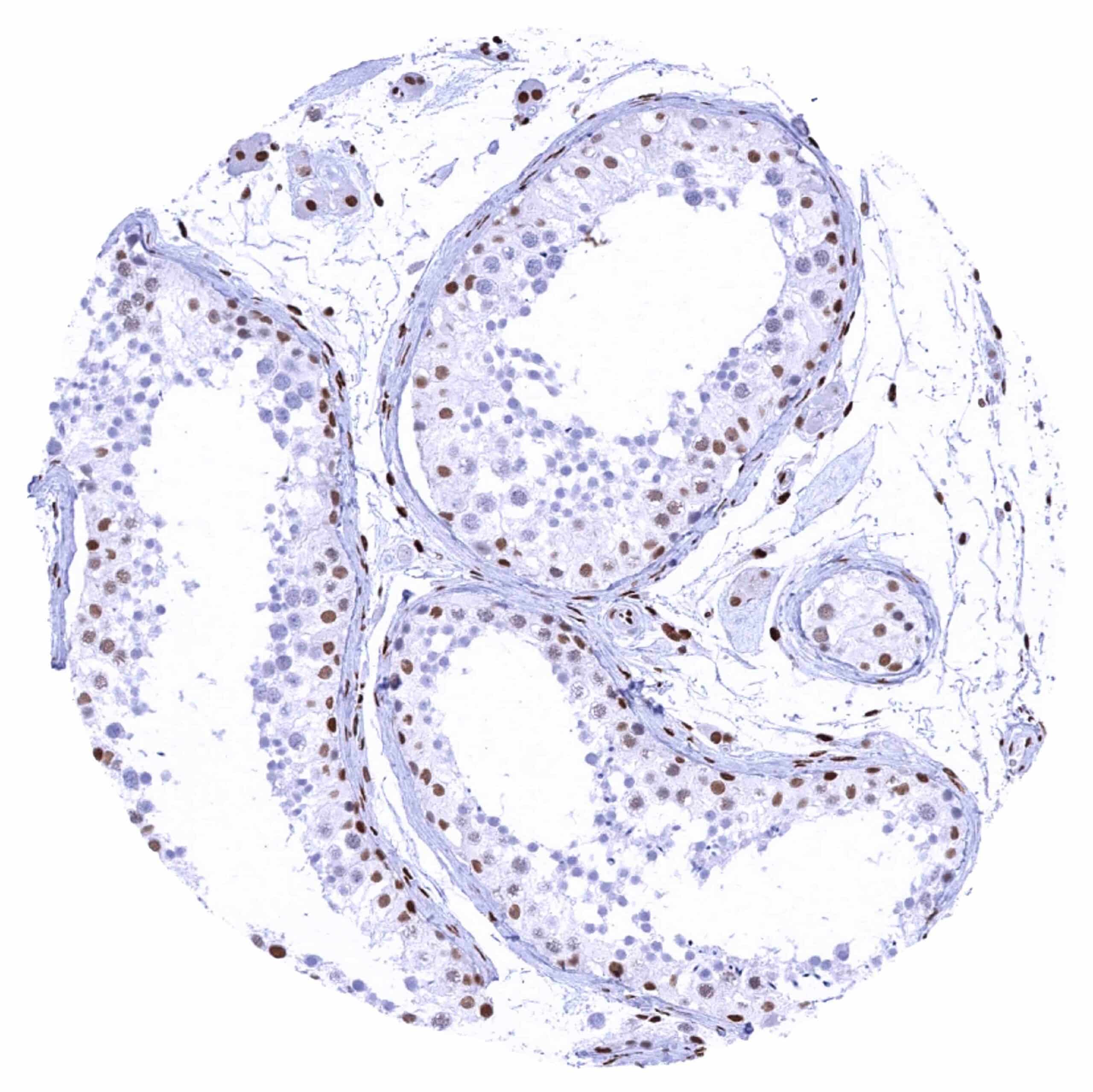 Glucocorticoid Receptor (HMV304) - MS Validated Antibodies