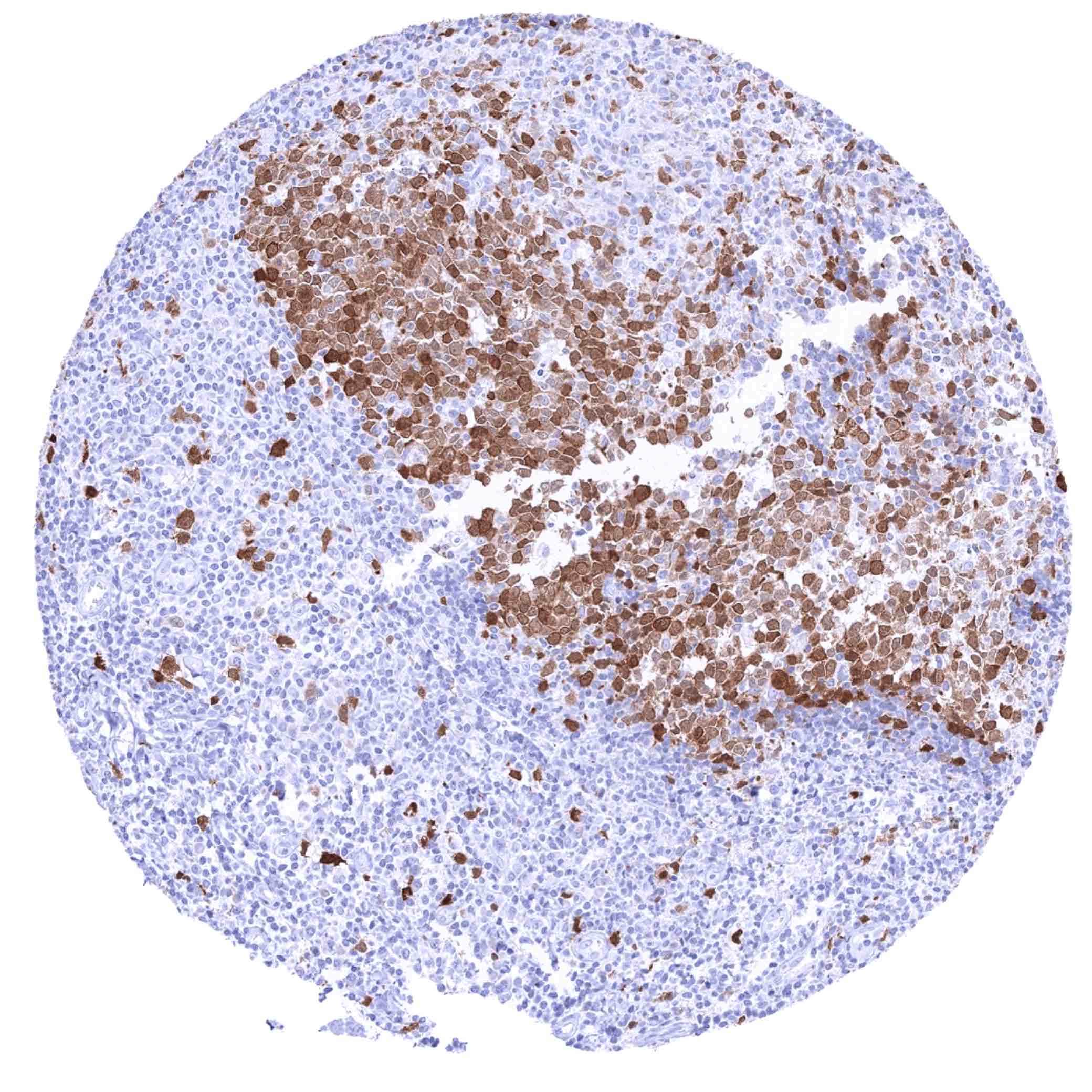 TYMS (HMV305) - MS Validated Antibodies