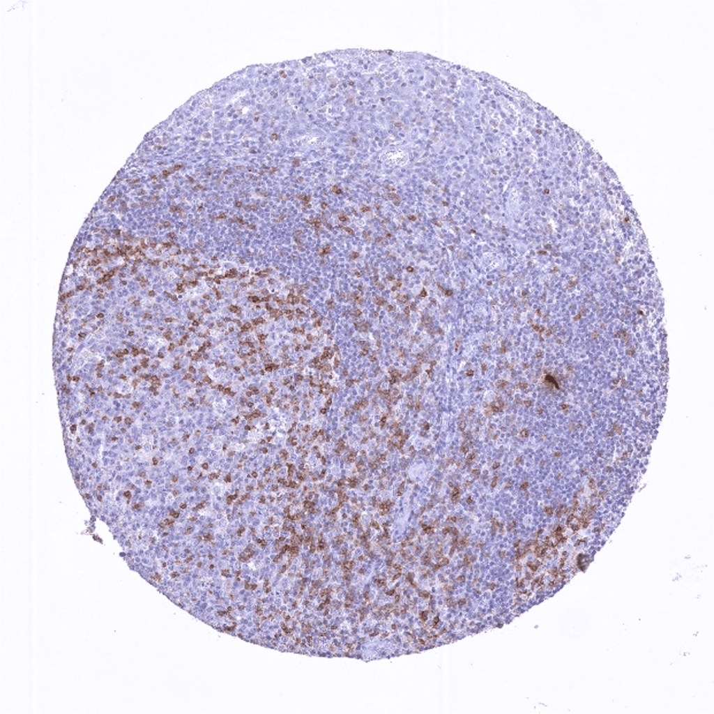 TIGIT (HMV322) - MS Validated Antibodies