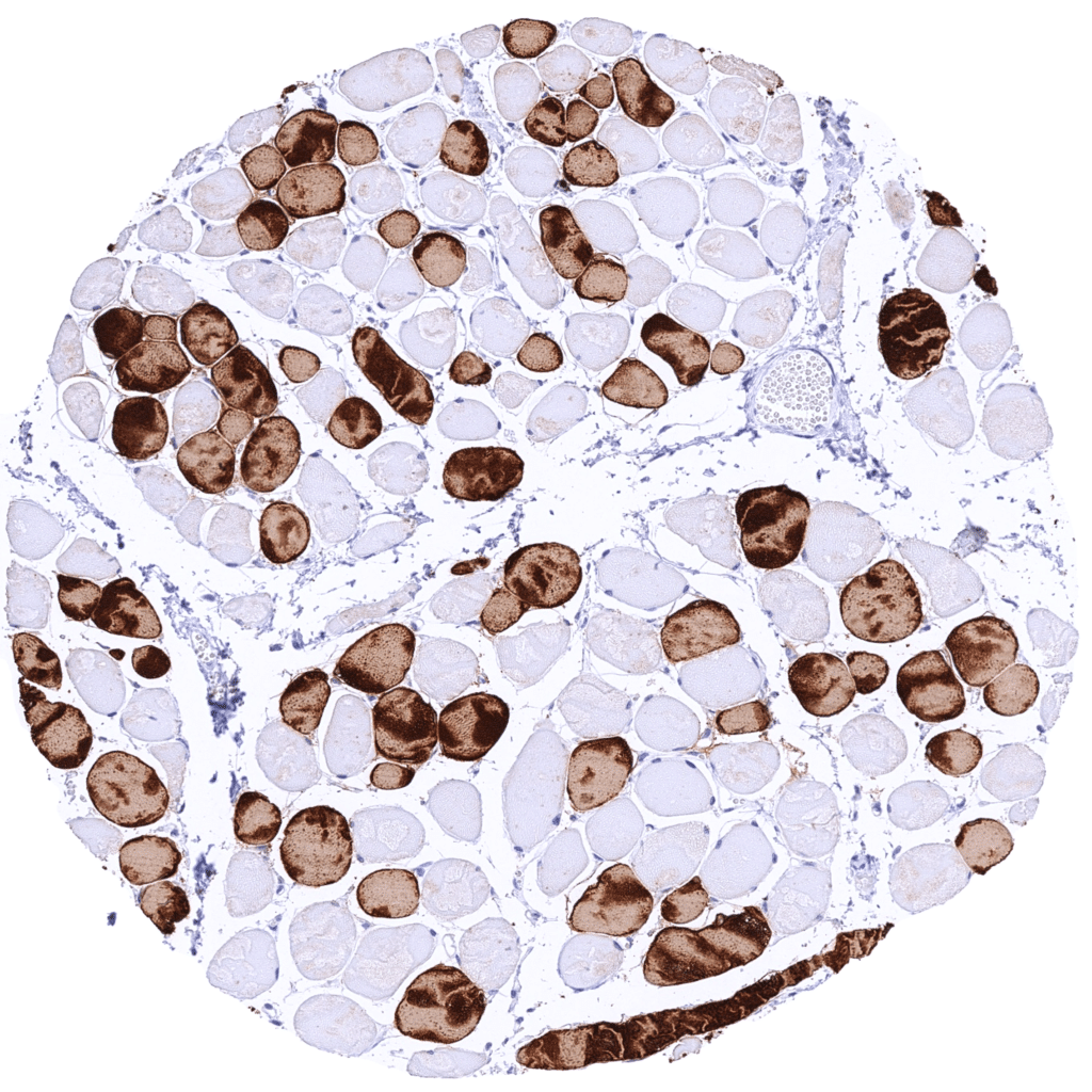 MYH7 / Myosin Heavy Chain 7 (MSVA-464M) - MS Validated Antibodies