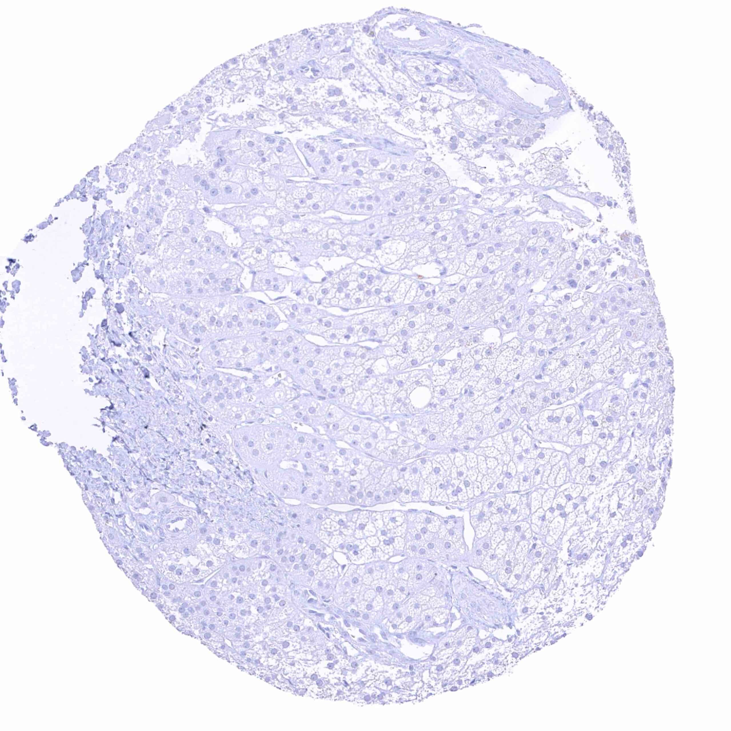 Normal Tissue Gallery Brachyury - MS Validated Antibodies