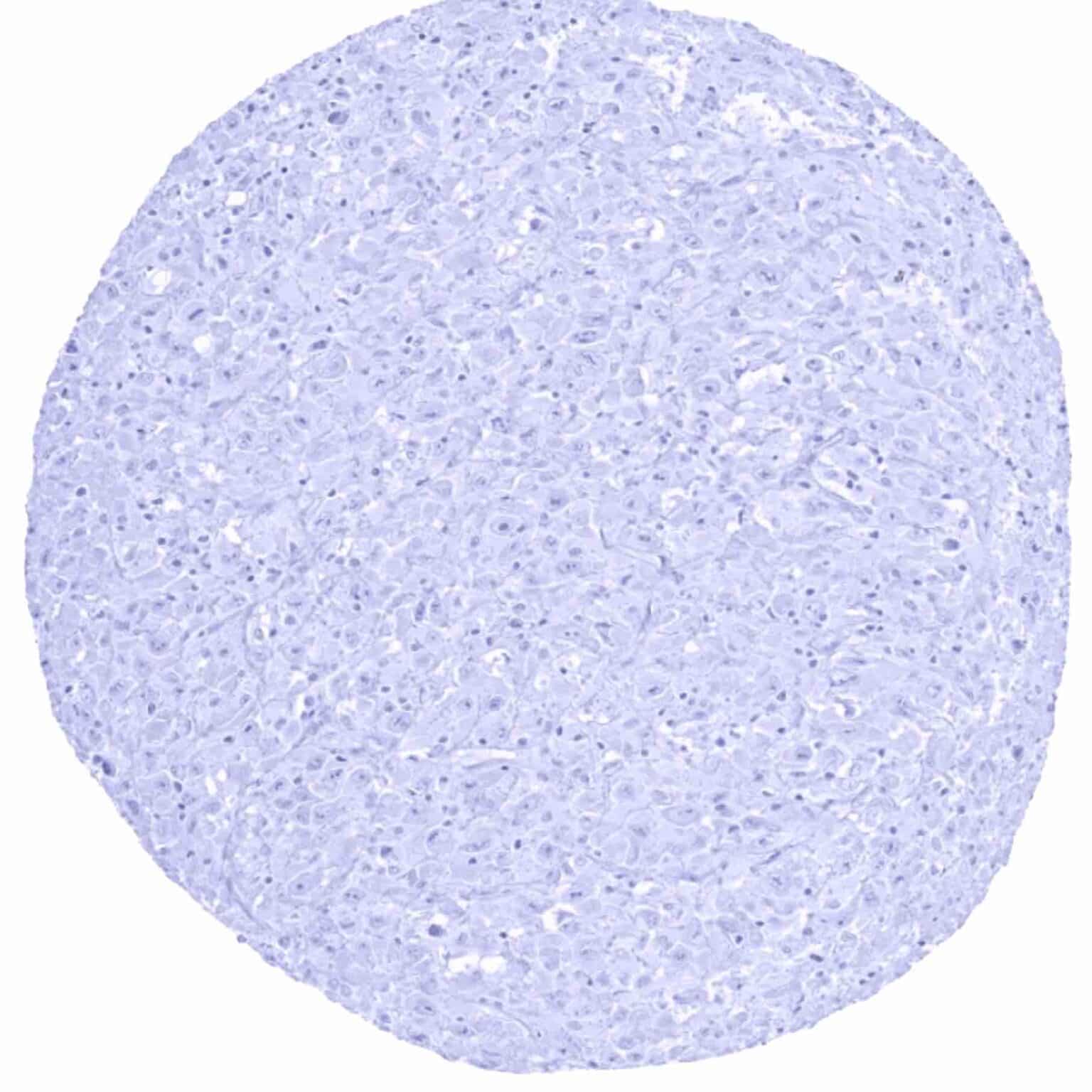 Cancer Tissue Gallery Brachyury - MS Validated Antibodies